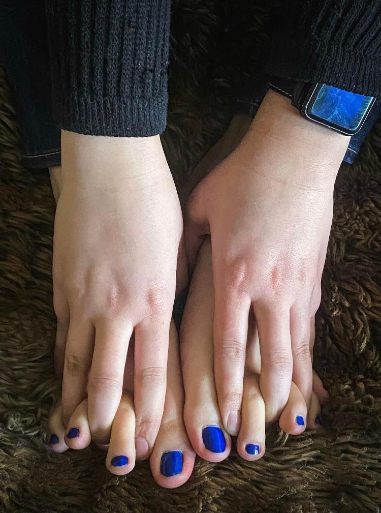 Do you like fingers between toes? | Scrolller