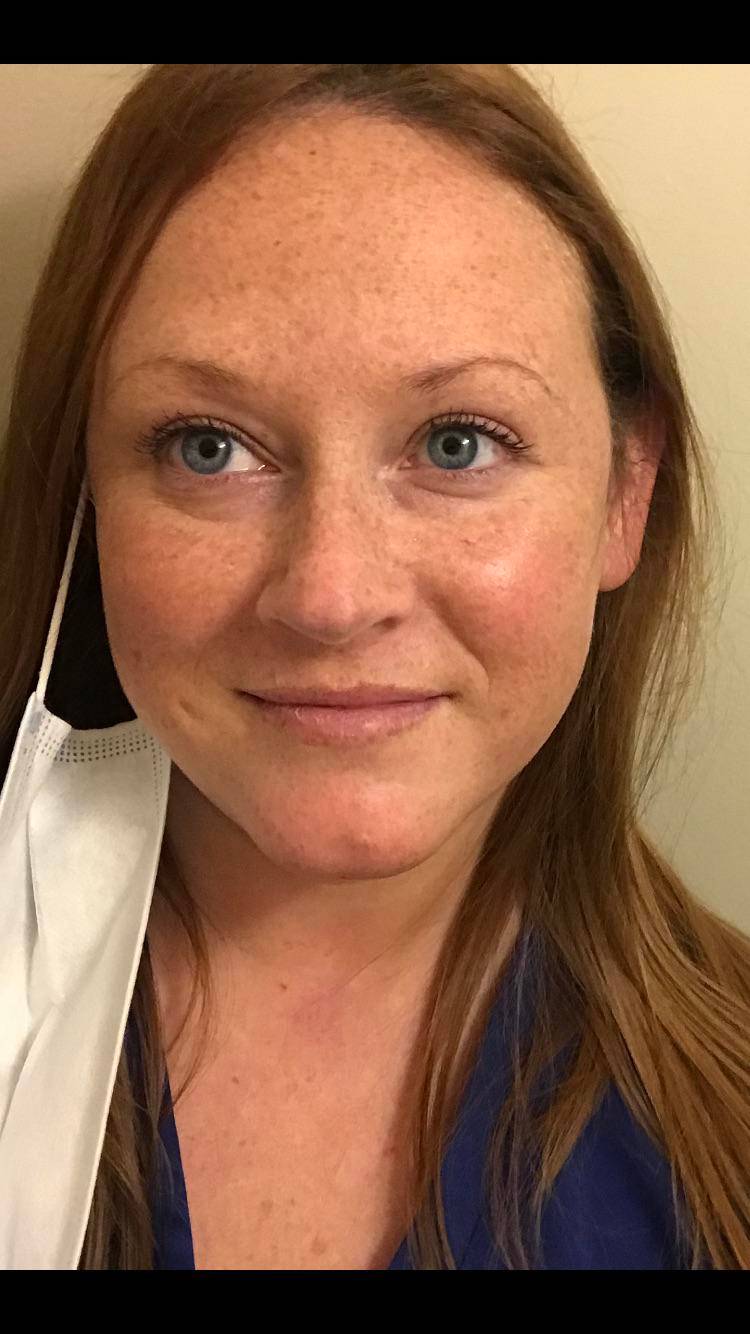 My freckle face | Scrolller