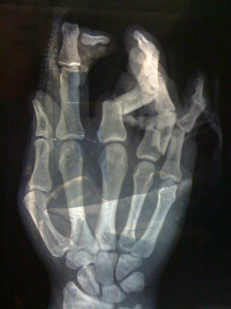 My friends xray | Scrolller