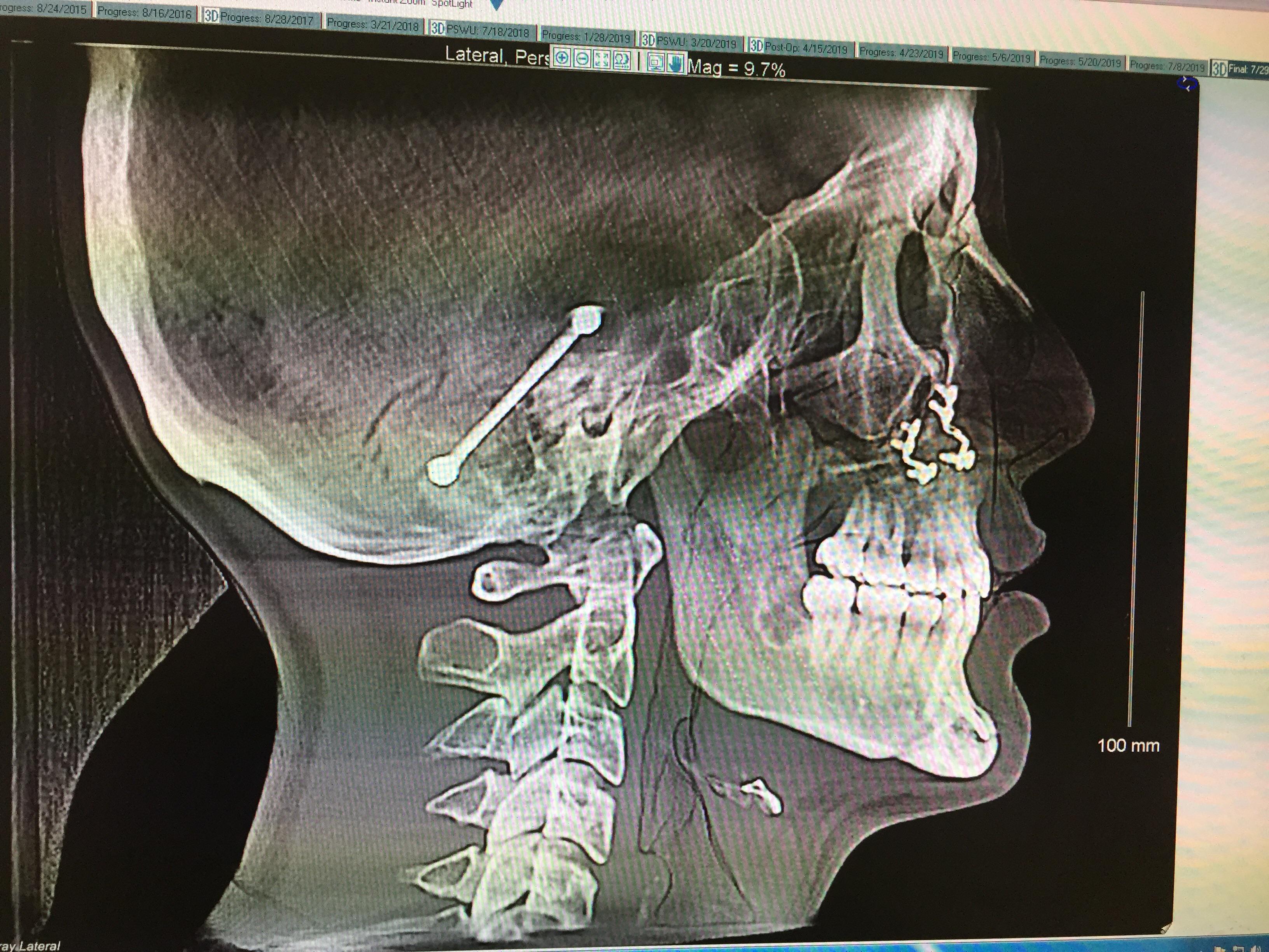My industrial under an X-ray | Scrolller