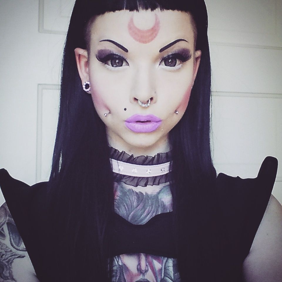 My Luna scar after the ten day aftercare period :) | Scrolller