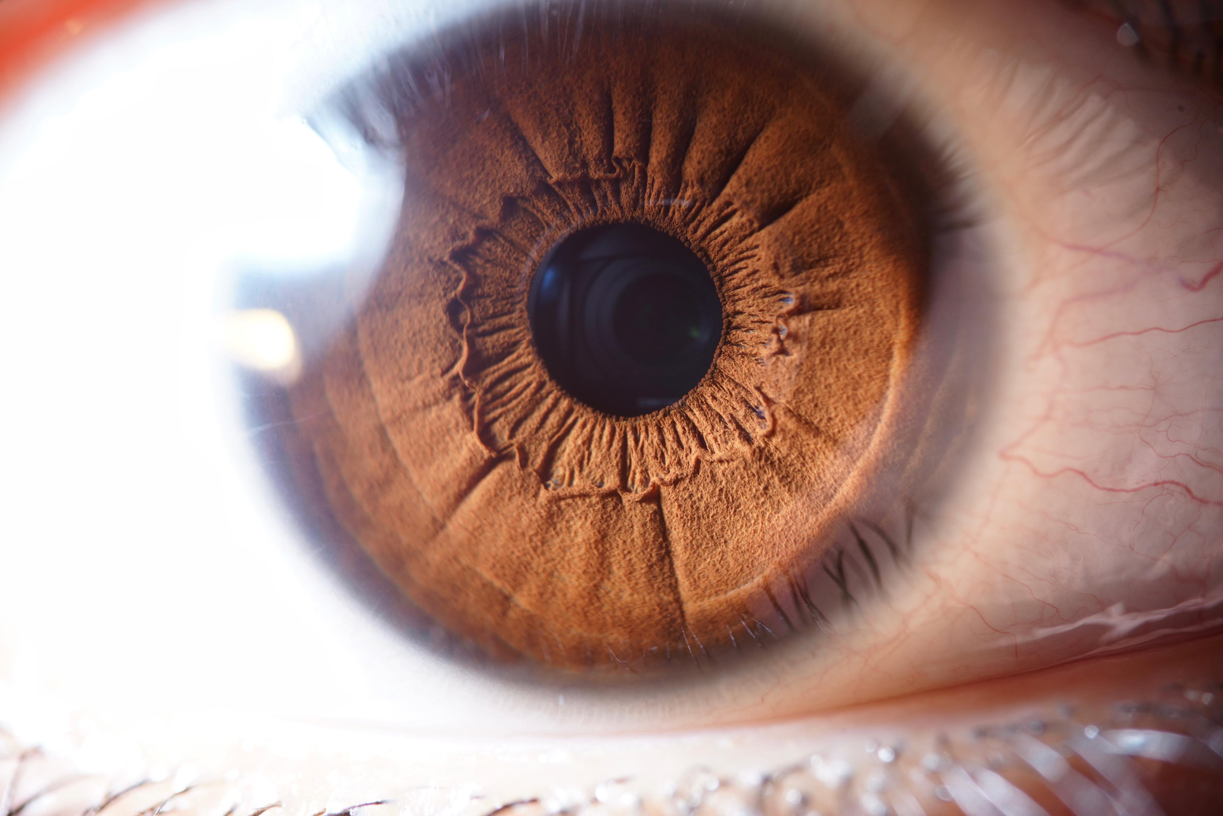 My Sister’s iris | Scrolller