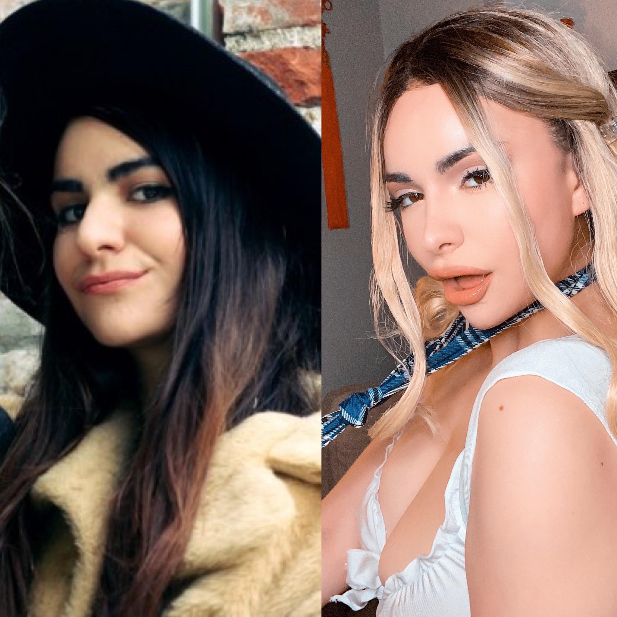 💖💖 my transformation so far turning into a bimbo! can’t wait for more surgeries 😍💖 | Scrolller