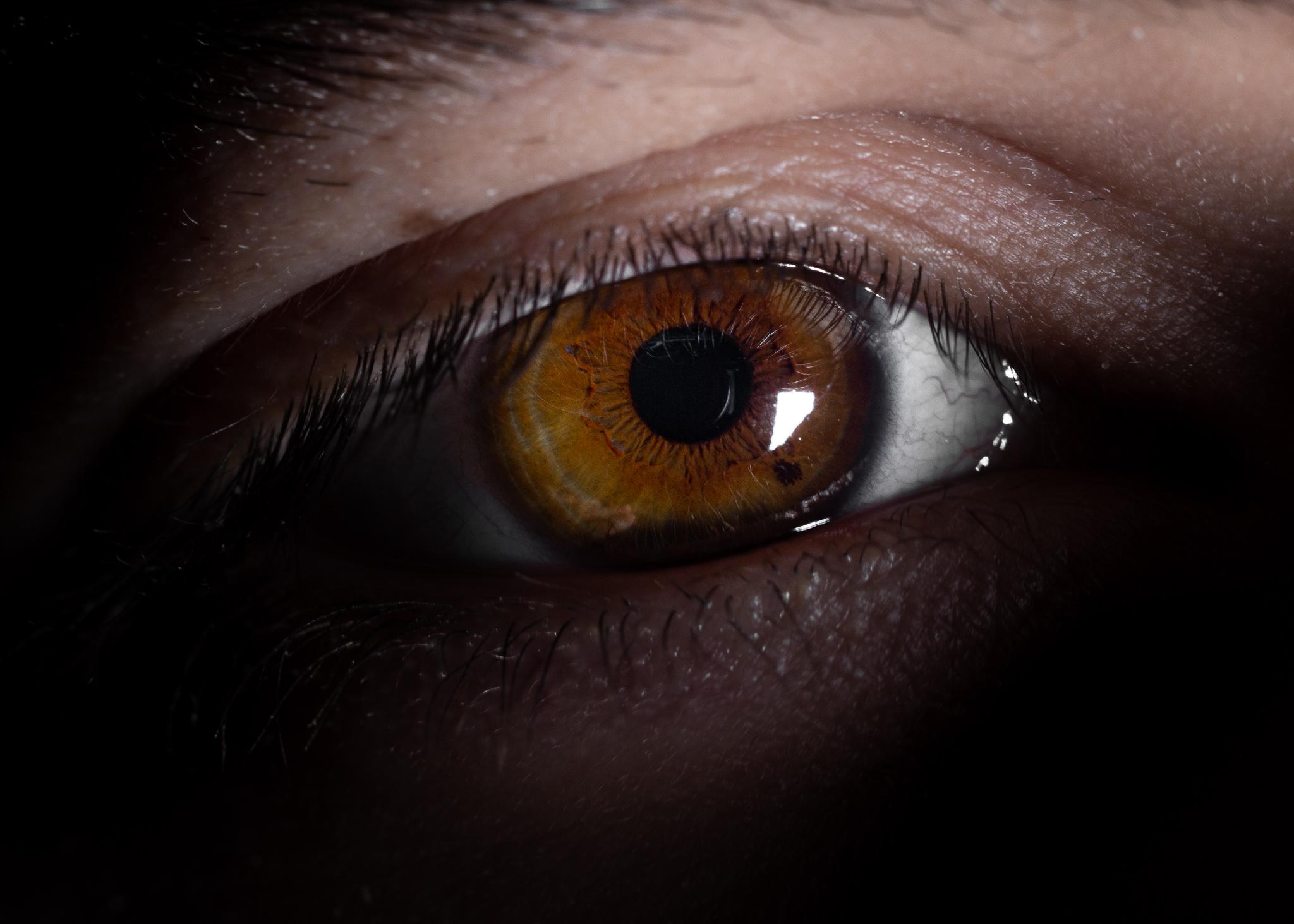 Narrow light on my eye | Scrolller