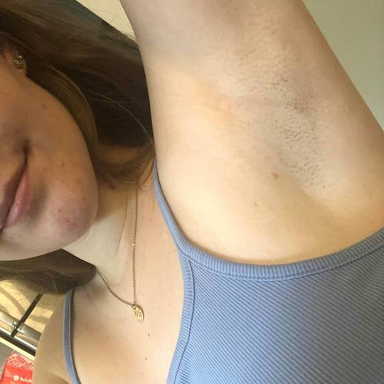 Natural clean armpits 👃👅 | Scrolller