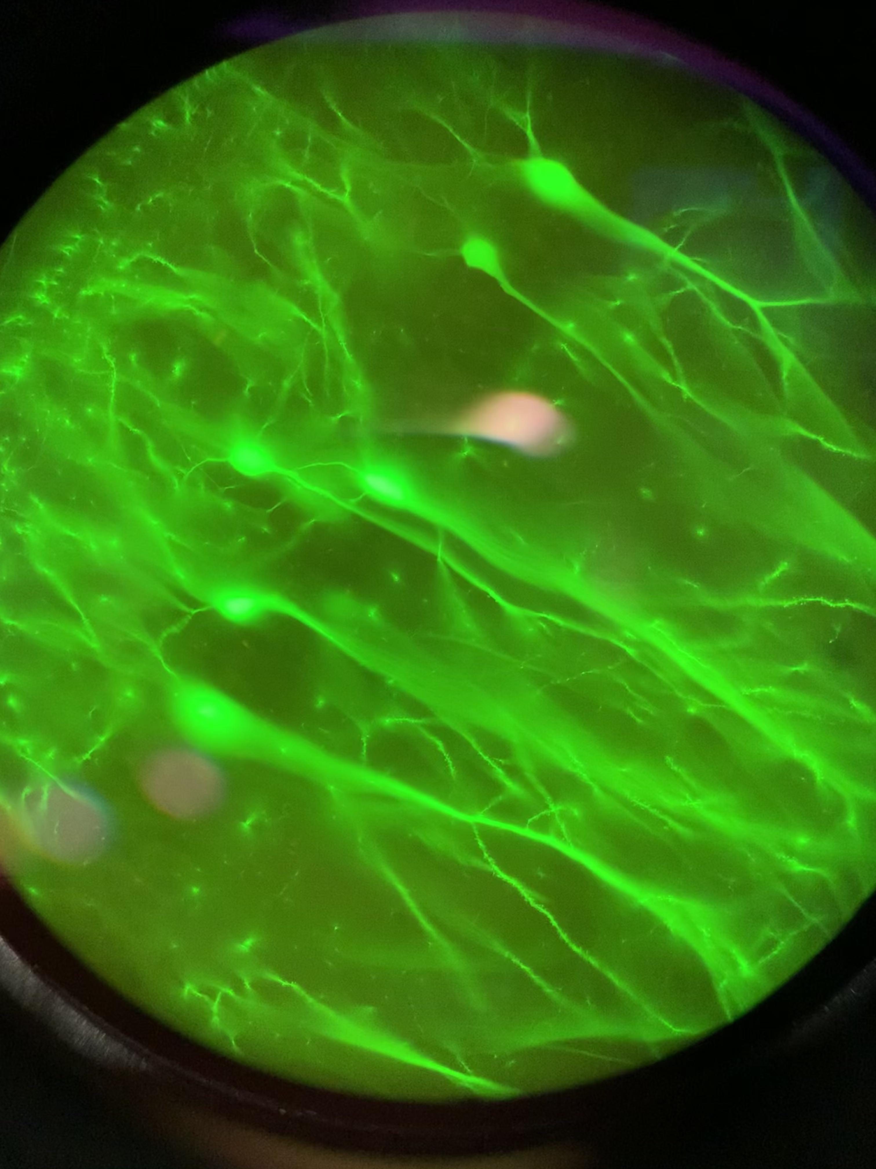 Neurons expressing GFP in brain tissue. View from the eyepiece 👁 ...