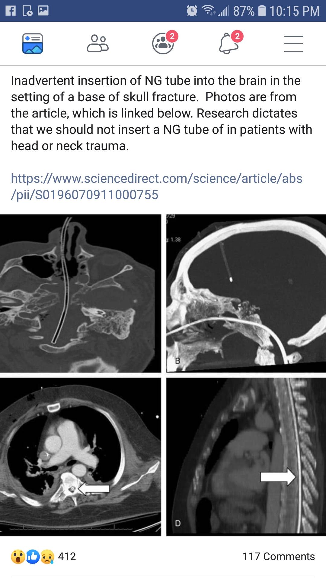 NG insertion gone horribly, horribly wrong... | Scrolller