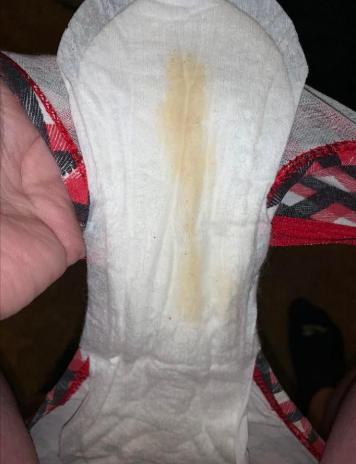 Nice discharge pic | Scrolller