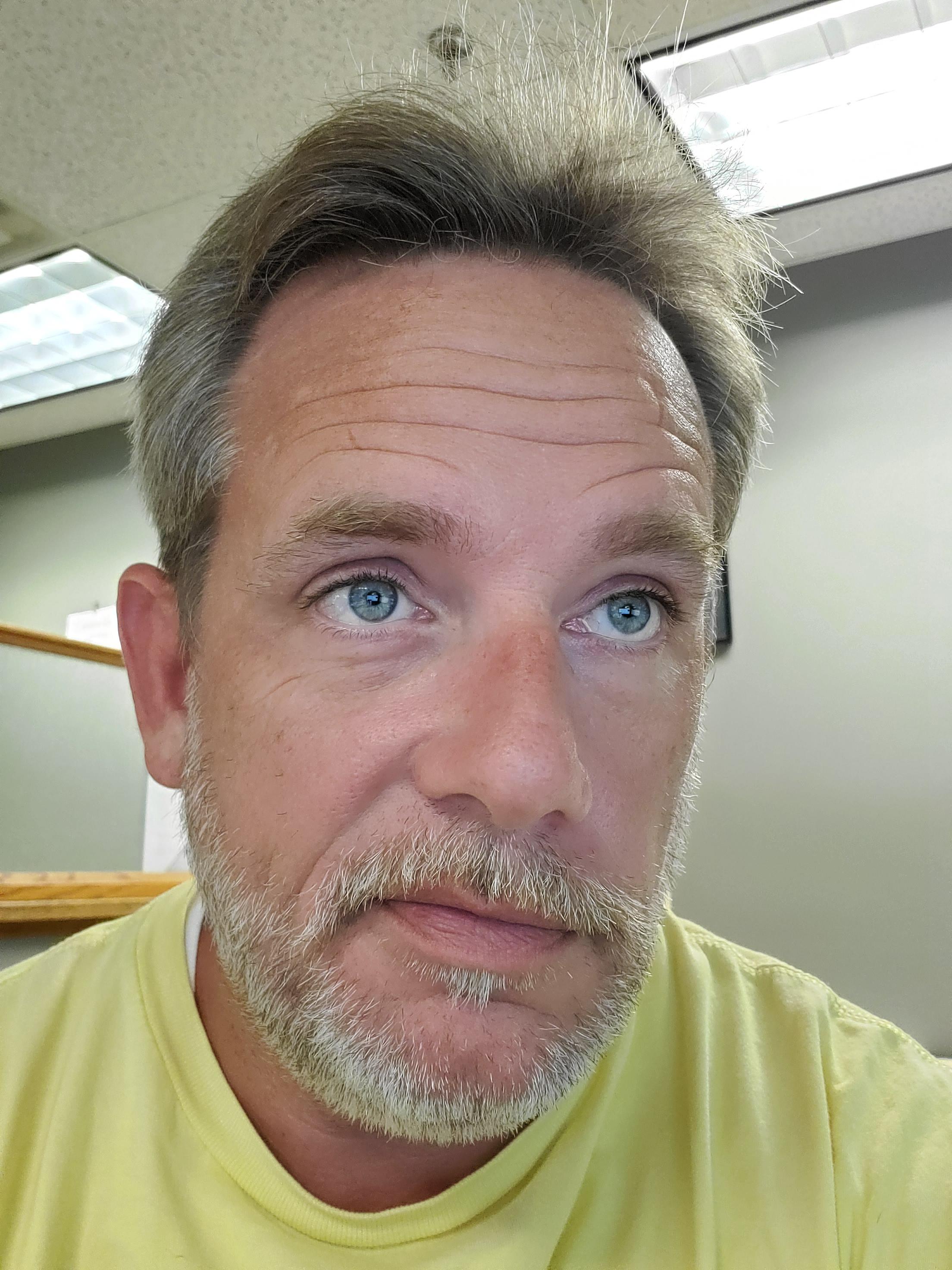 Nice face, said no one. | Scrolller