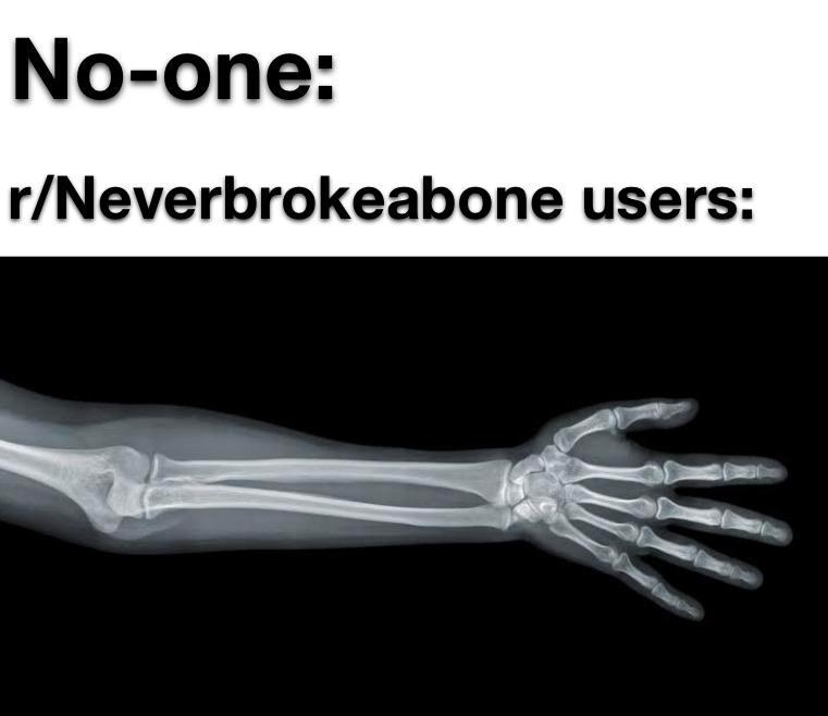 Non broken bone | Scrolller