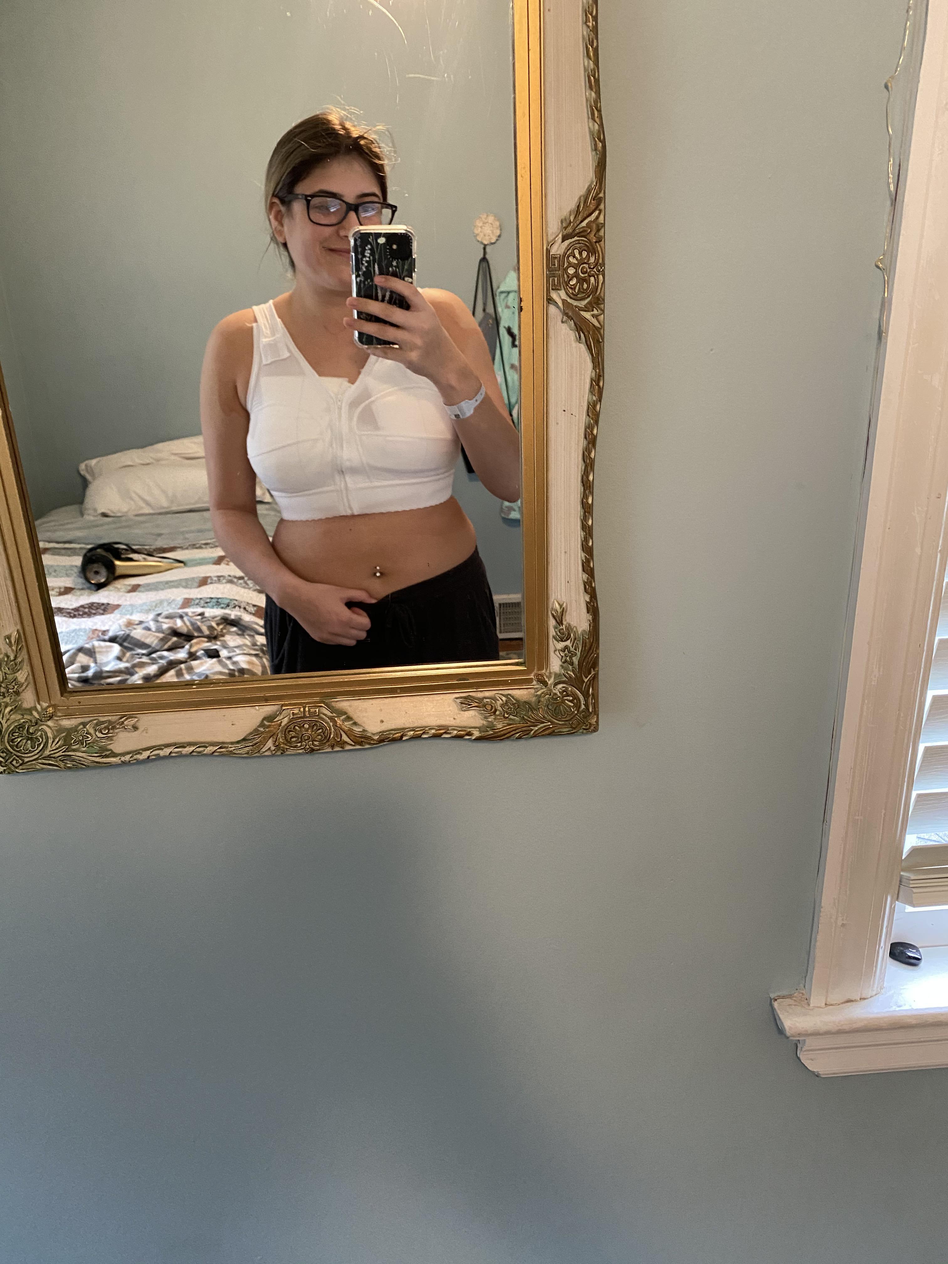 one day post op! 34GGG to ~ 34C/D. haven’t been this happy in a while! | Scrolller