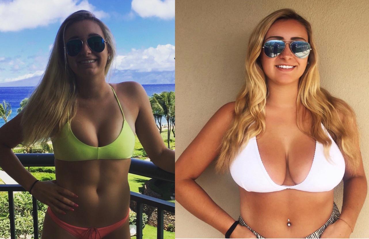 ONE YEAR DIFFERENCE | Scrolller