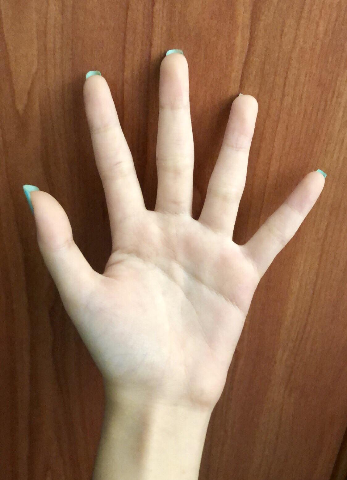 Palm pic? | Scrolller