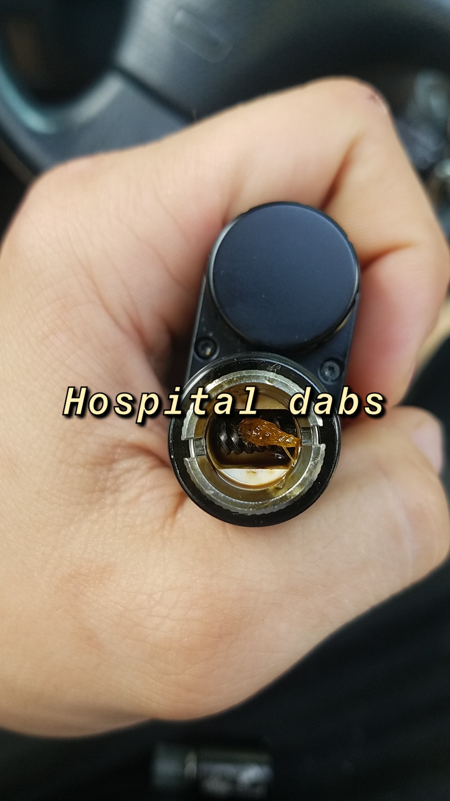 Parking lot dabs while the lady gets her knee fixed 🏥 | Scrolller