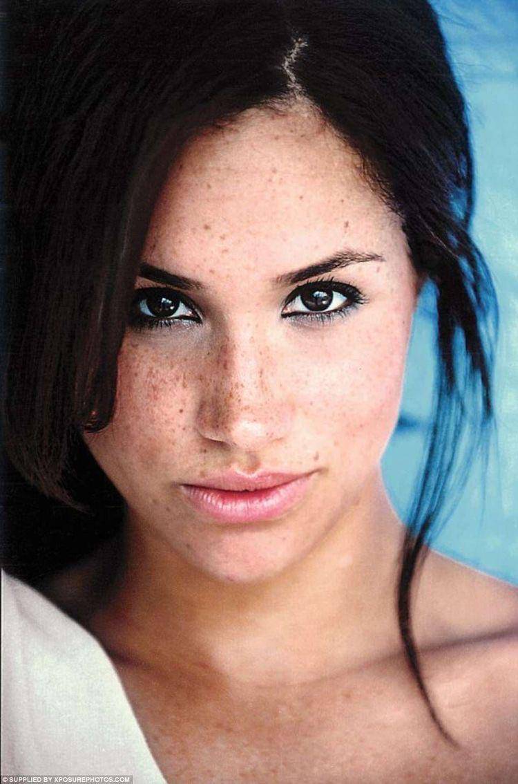 Perfect freckles | Scrolller