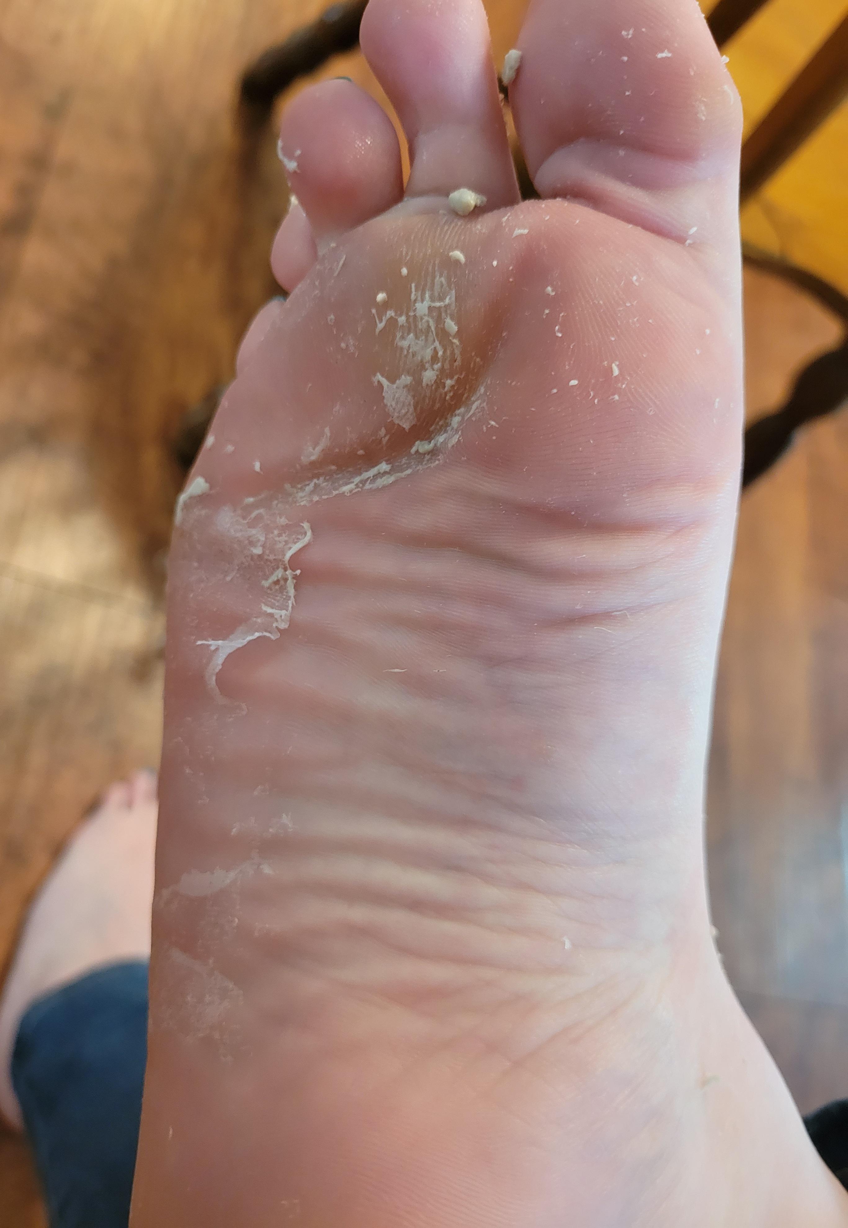 Played with some glue this morning. | Scrolller