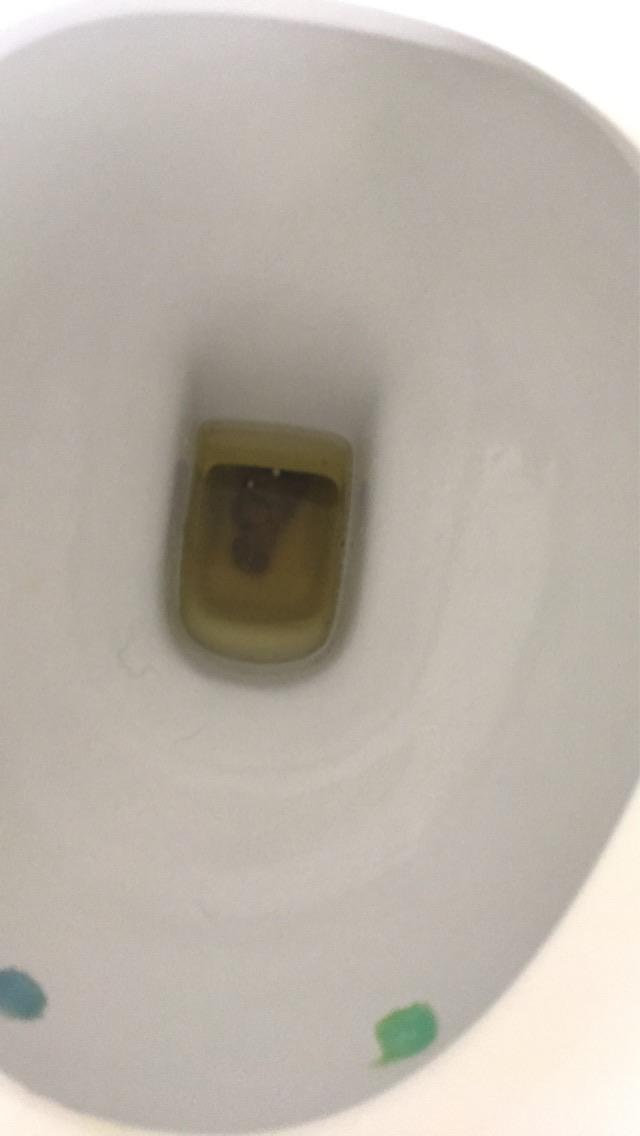 Poo flavoured pee | Scrolller