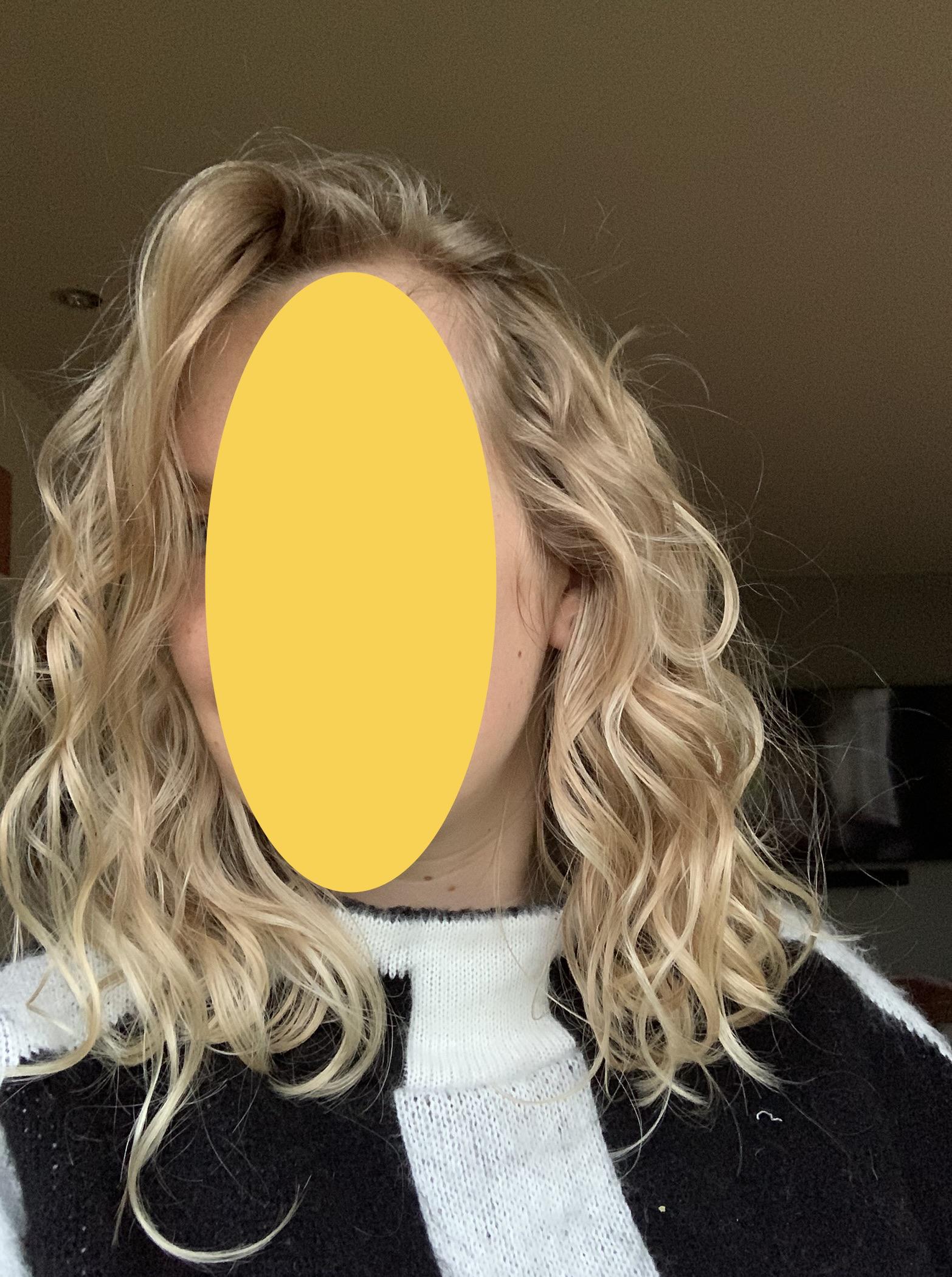 Postpartum Hair Loss And Desperately In Need Of A Haircut But I Had A