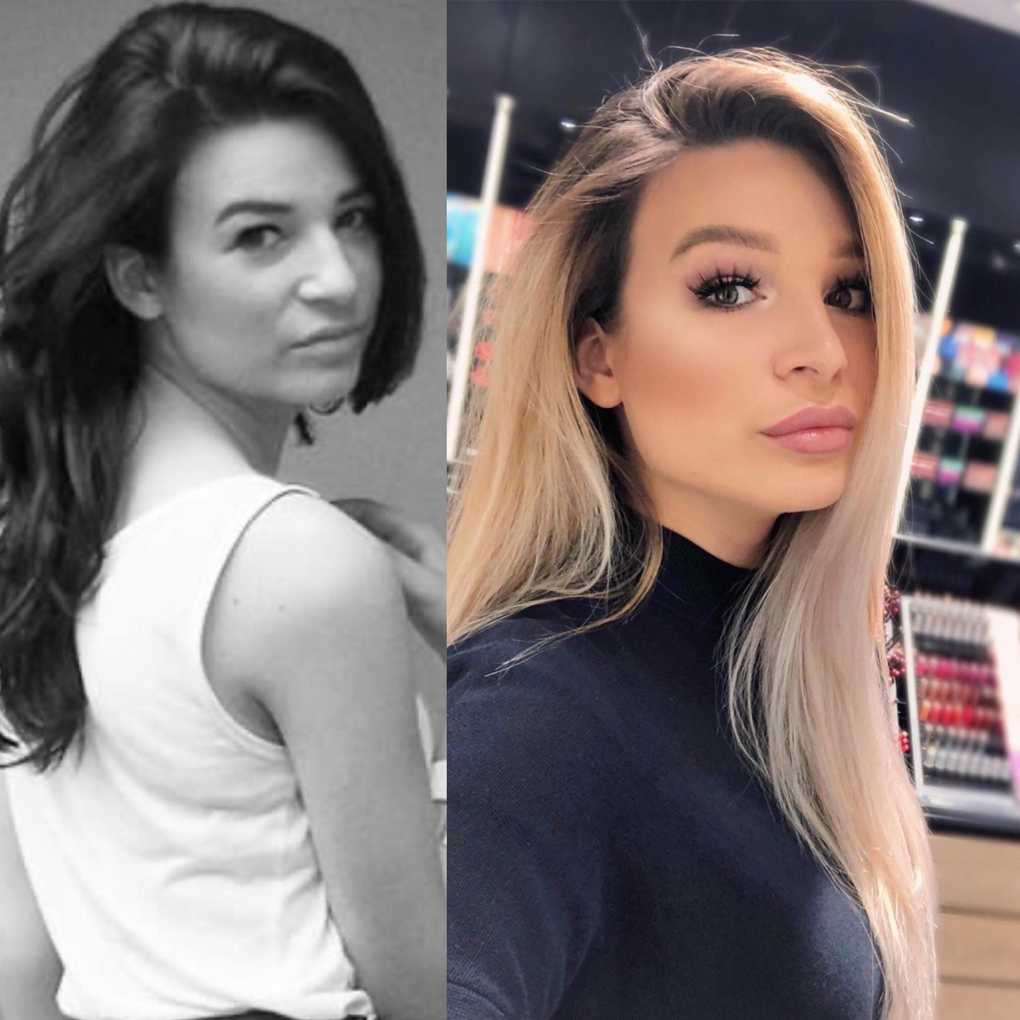 Progress 💉😍 | Scrolller