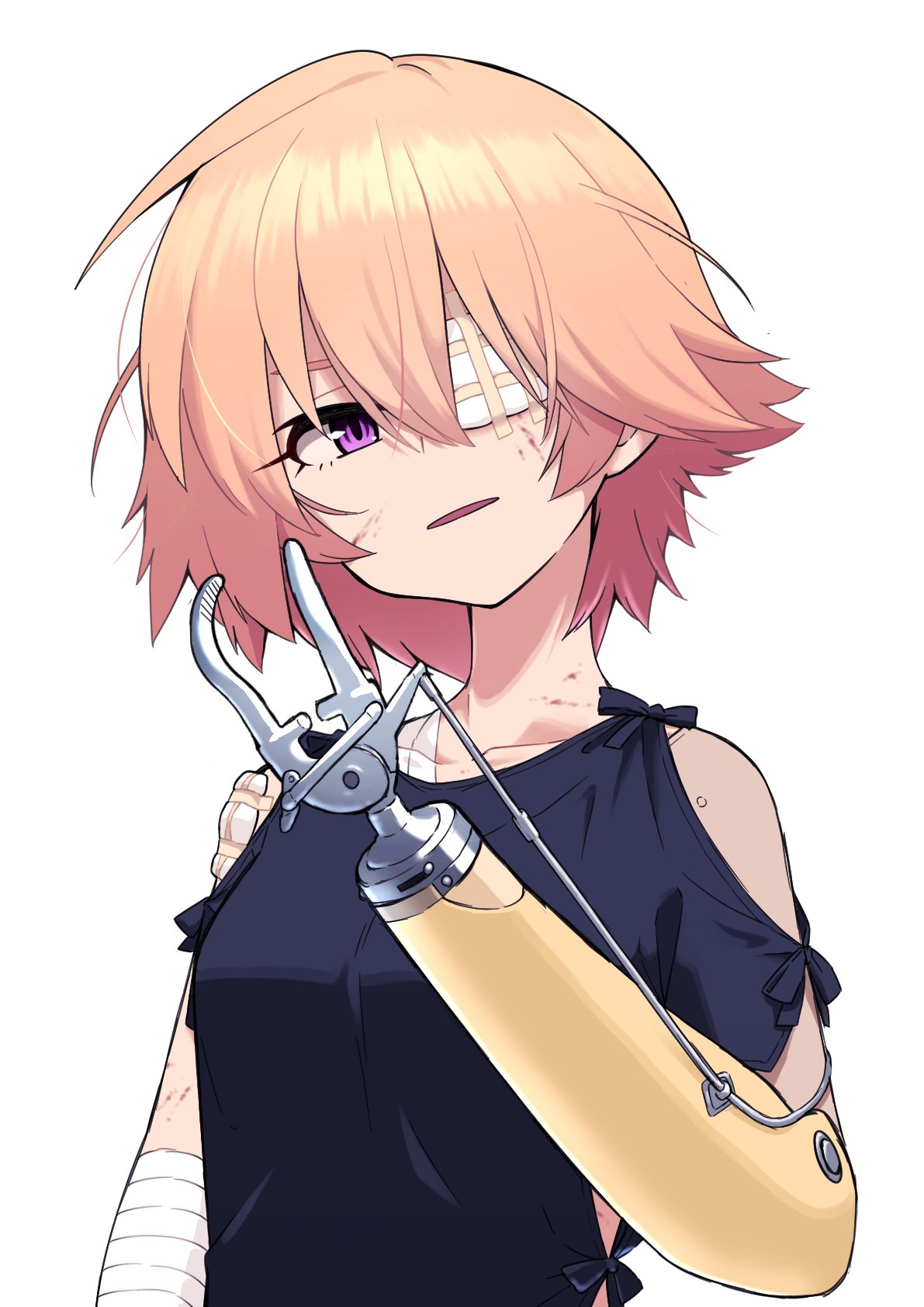 Prosthetic arm [original] | Scrolller