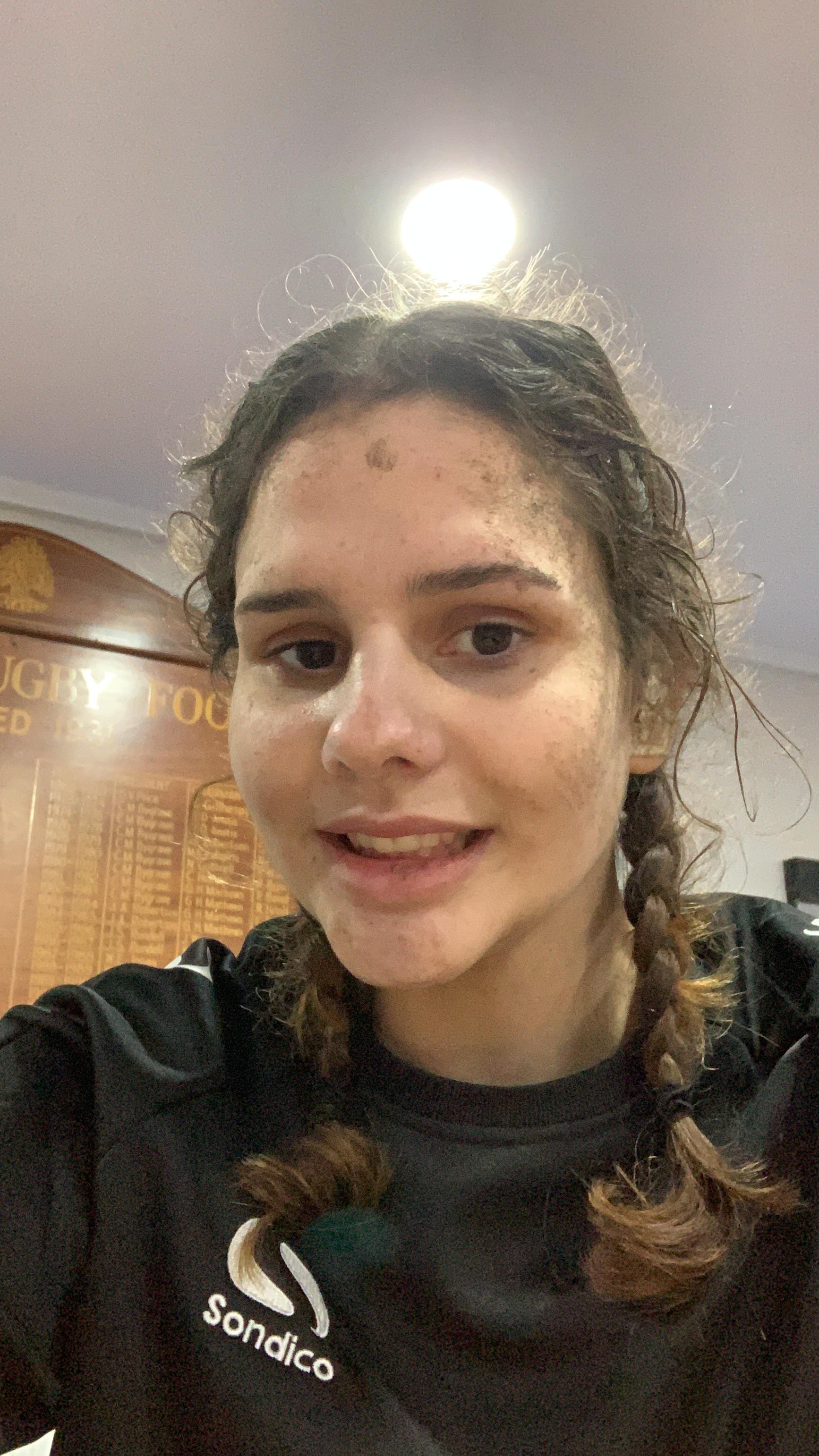 Rugby yes I am pulling a face | Scrolller