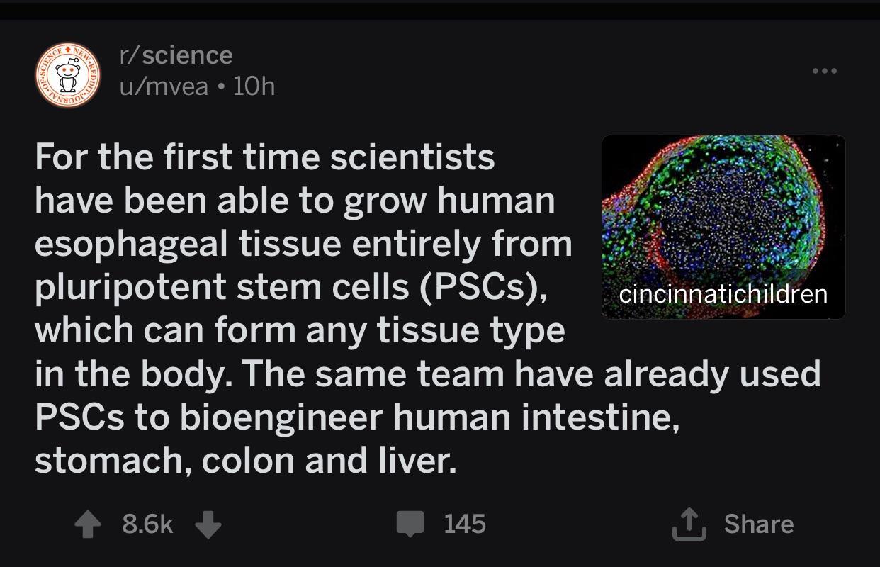 (Science and news) HMMMM | Scrolller