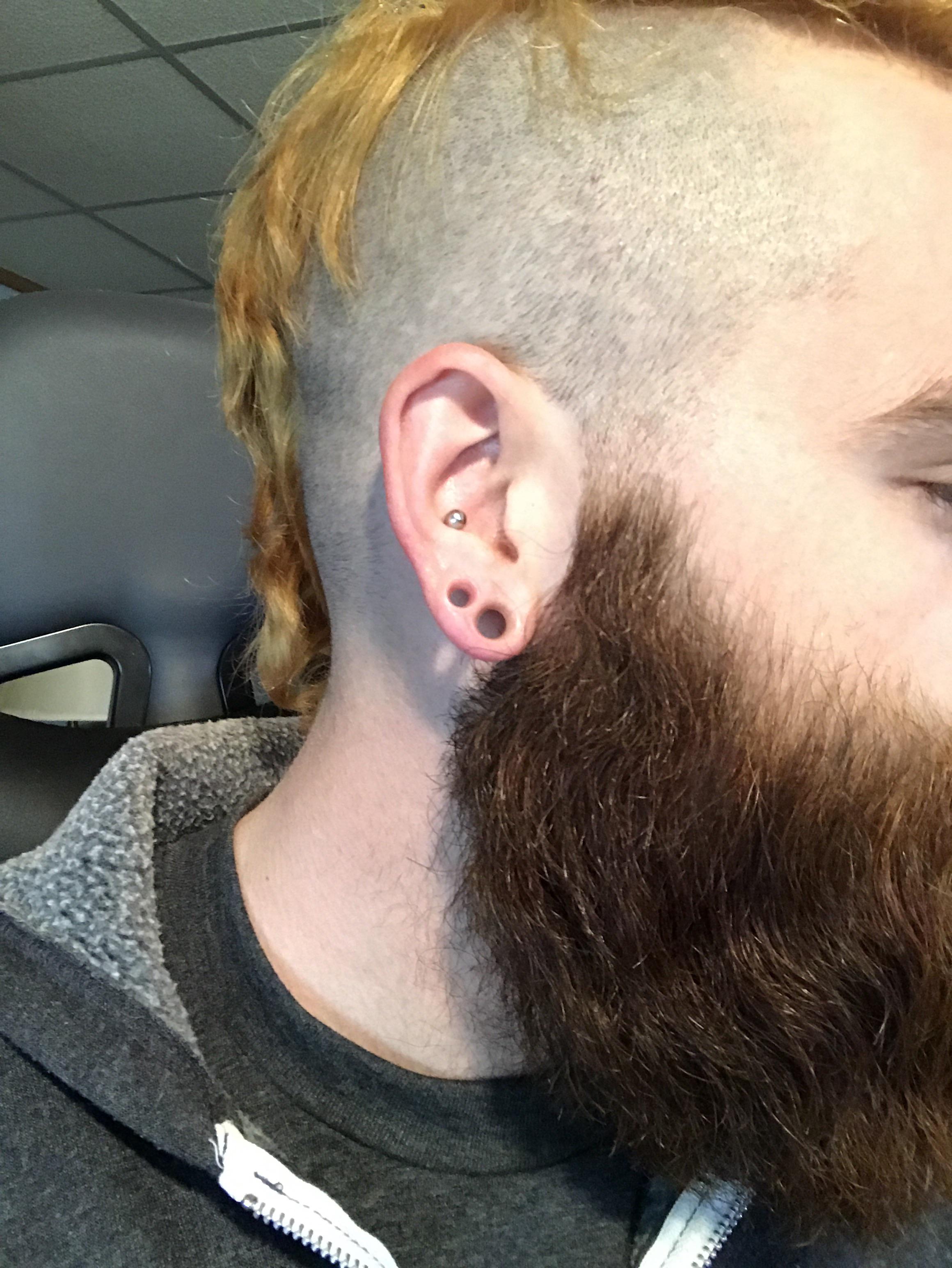 Second lobes finally healed up enough for some earskins! | Scrolller