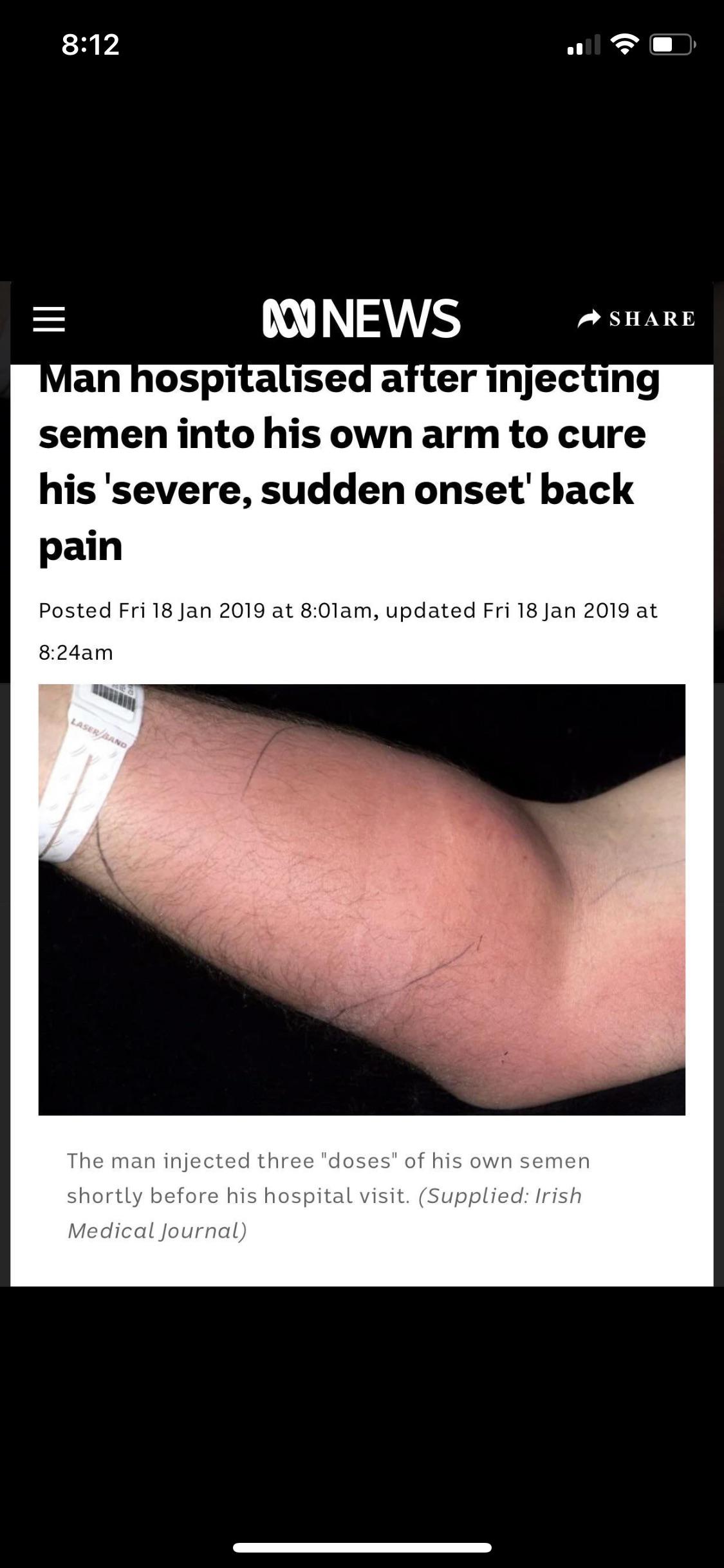 Semen Syringe | Scrolller