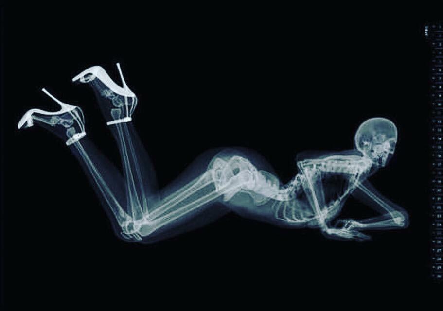 Sexy Skeleton | Scrolller