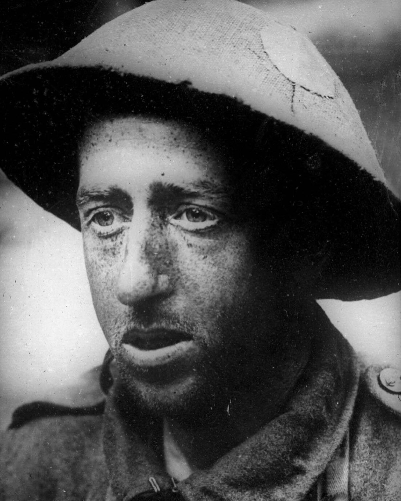 Shell-shocked British soldier at the Battle of the Somme, 1916 | Scrolller
