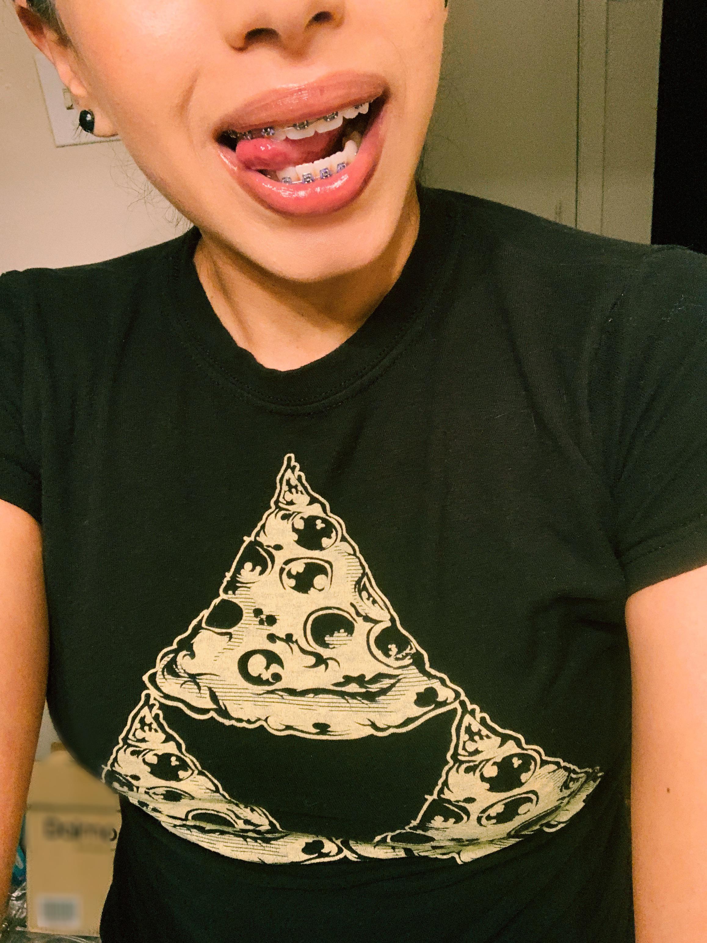 Showing off my braces 😬 ️ | Scrolller