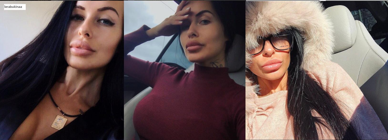 Silicone lips beauty | Scrolller