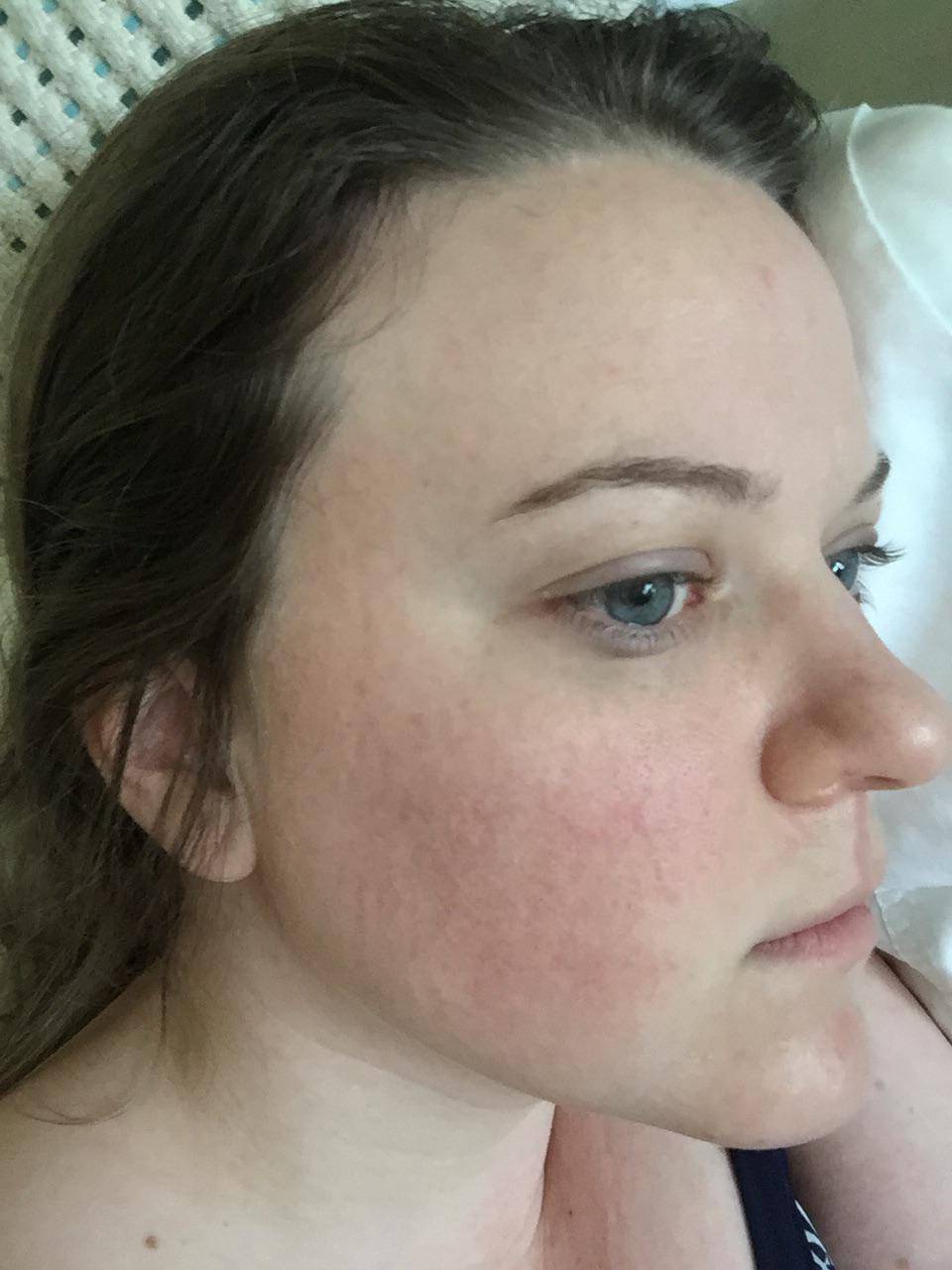 SKIN. SO. ITCHY. | Scrolller