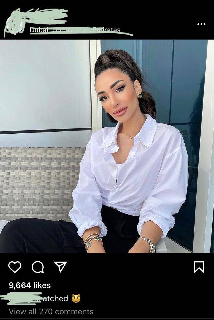 Skin texture?? | Scrolller