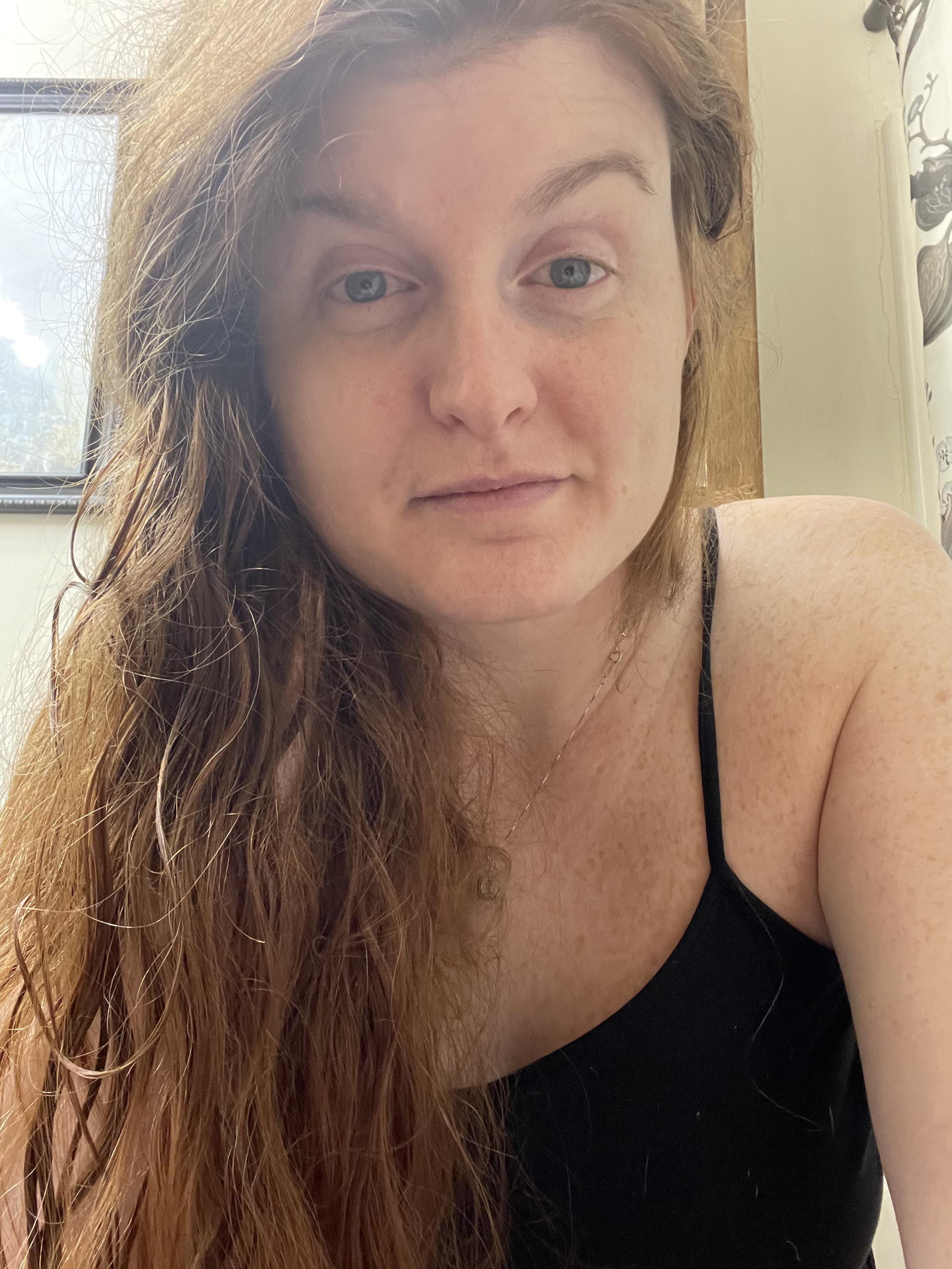 Sleepy freckles face 😴 | Scrolller