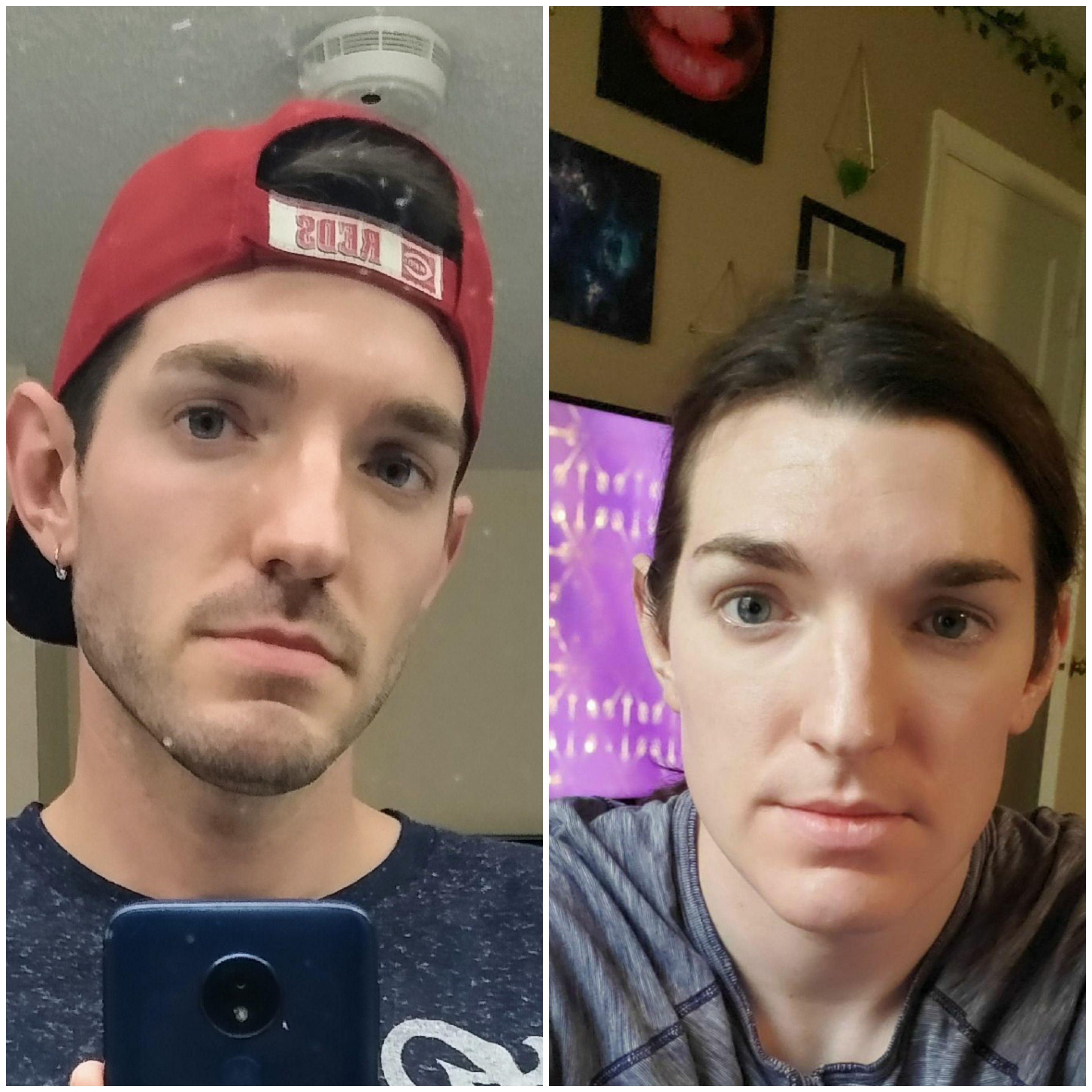 Slowly but surely. -2 mo/1yr 3 mo. 27 MtF. Changes seem so subtle until ...