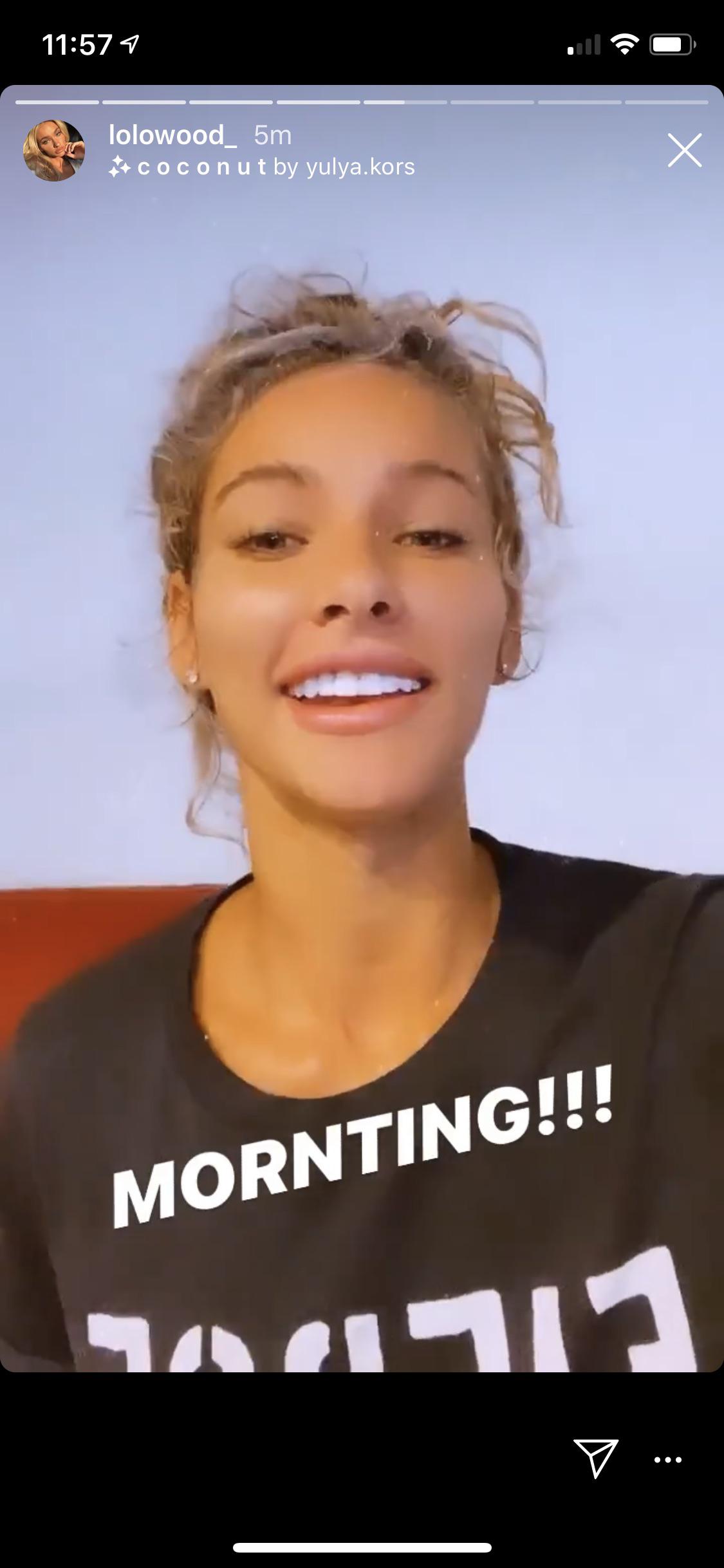 Smh looks like she’s gotten some fake teeth her teeth were already perfect 😥 | Scrolller