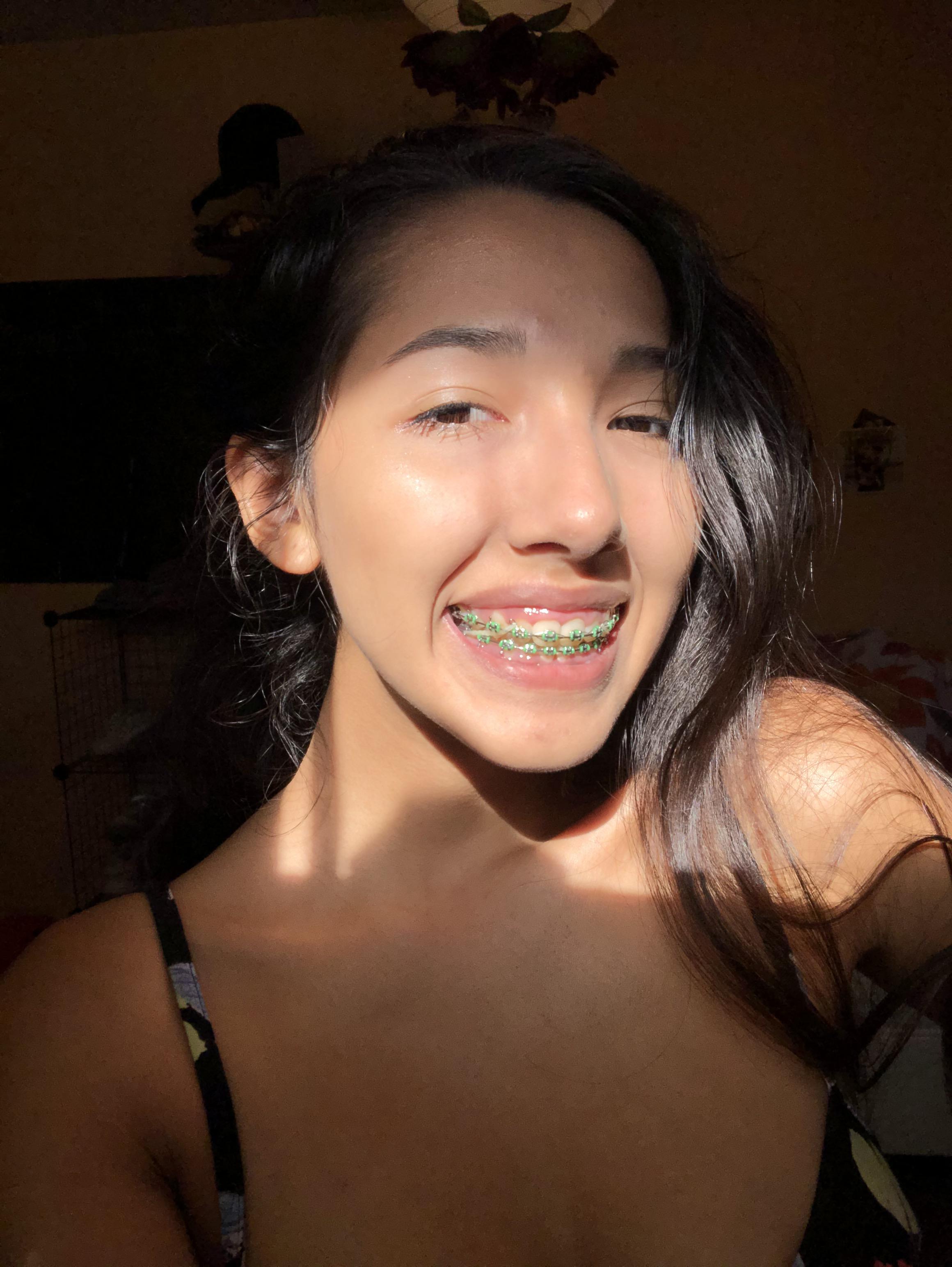 Smiling with all my teeth | Scrolller
