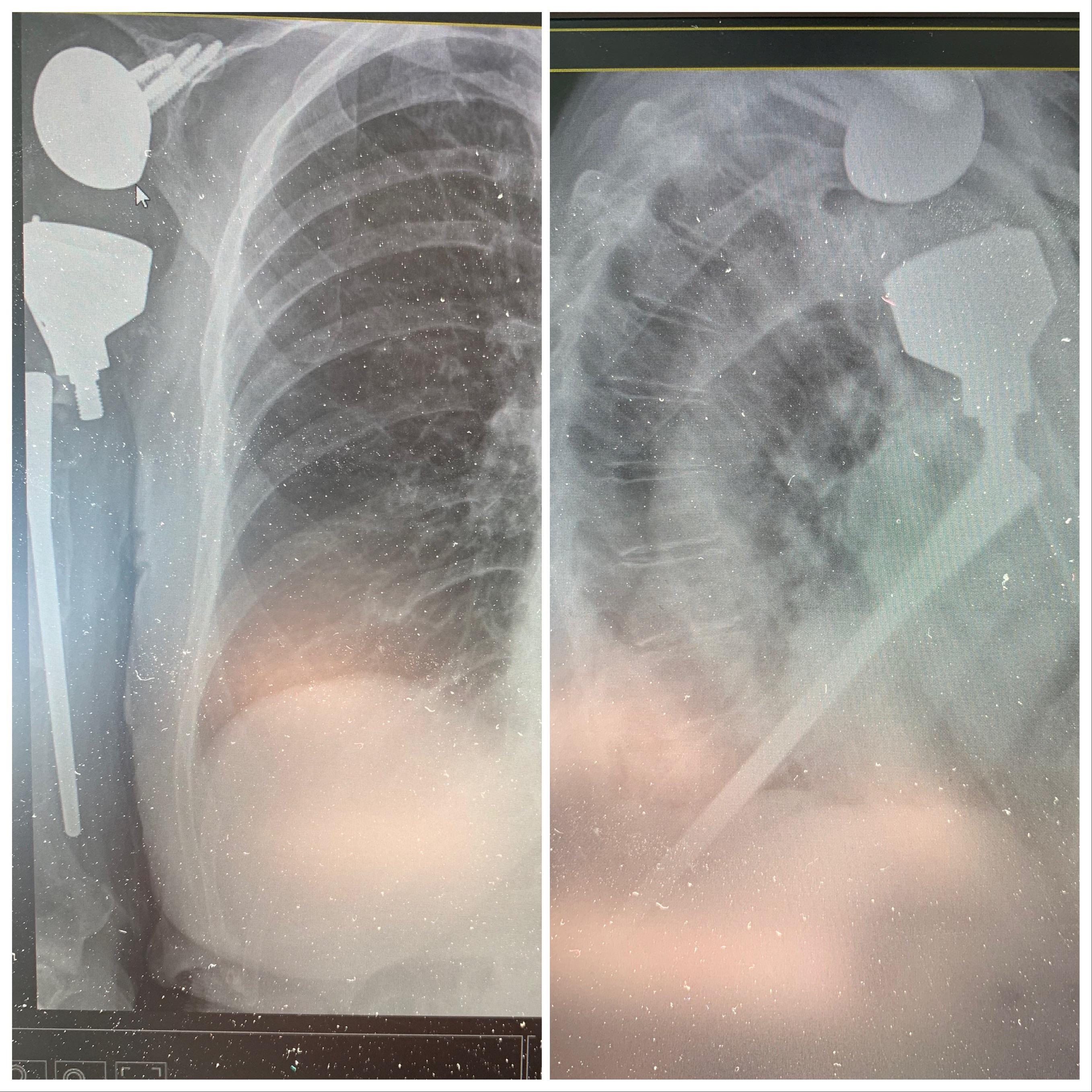 Some assembly required.. | Scrolller