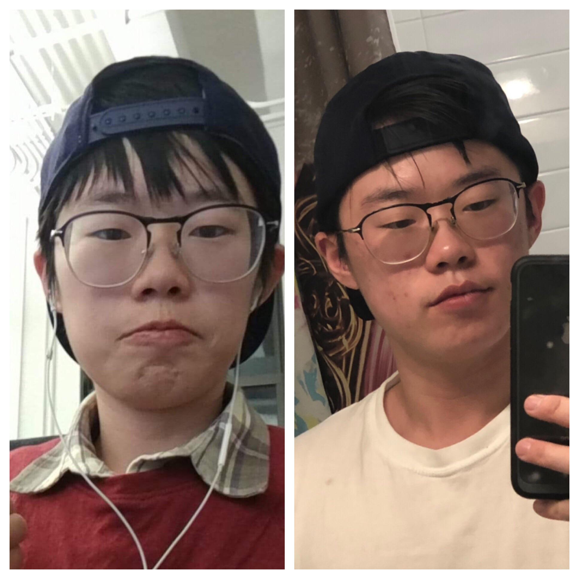 Some face gains 1.3ish years on T | Scrolller