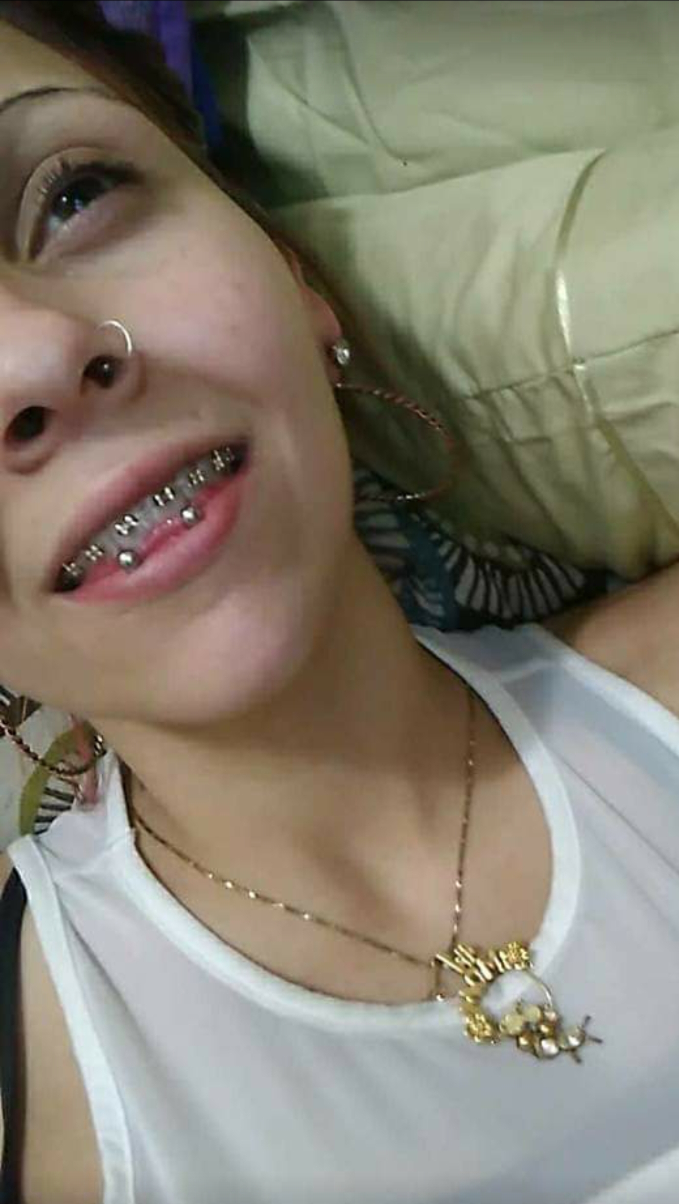 Soooooo ....... who wants to cum on my braces? | Scrolller