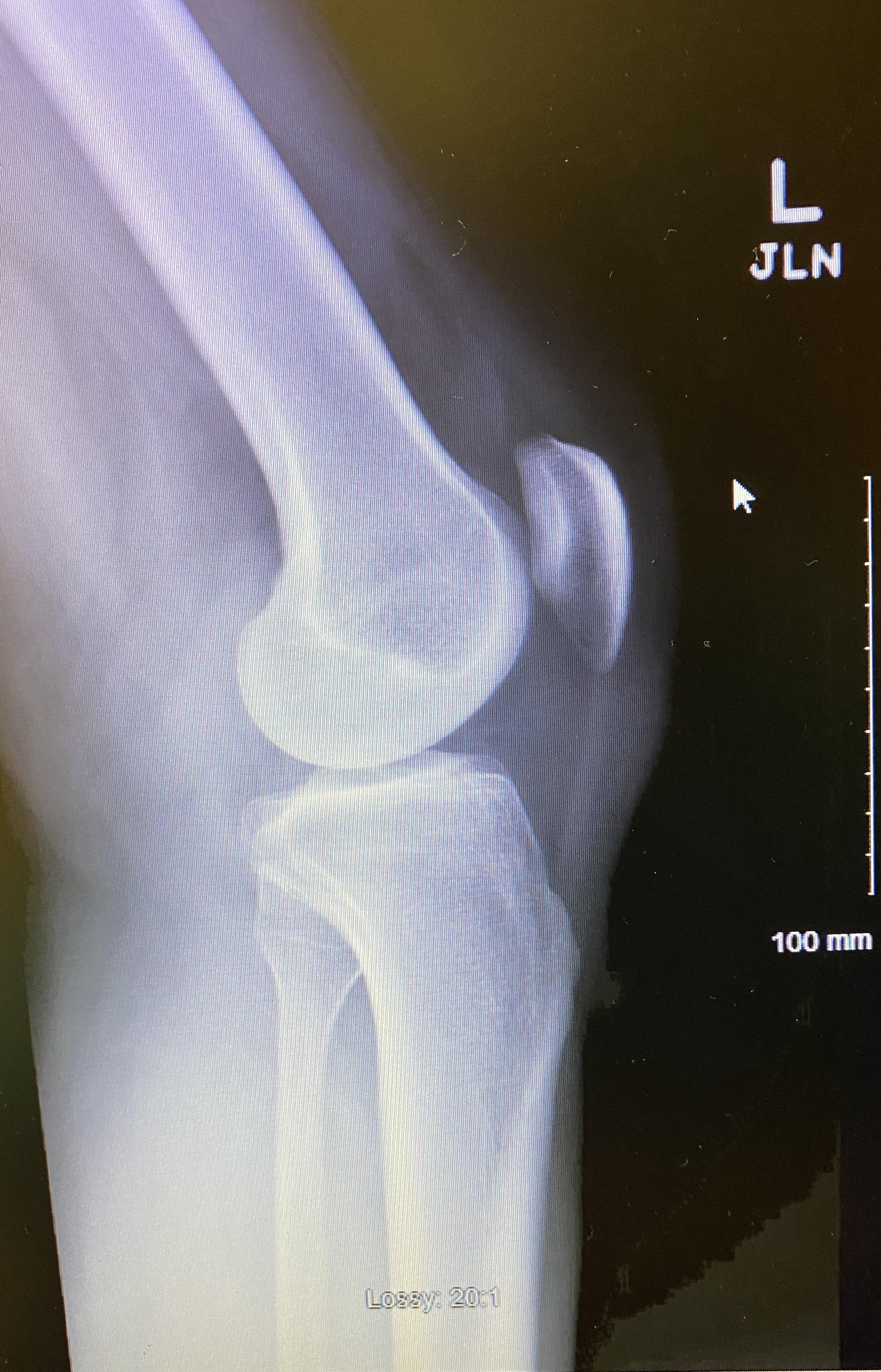Standing lateral knee | Scrolller