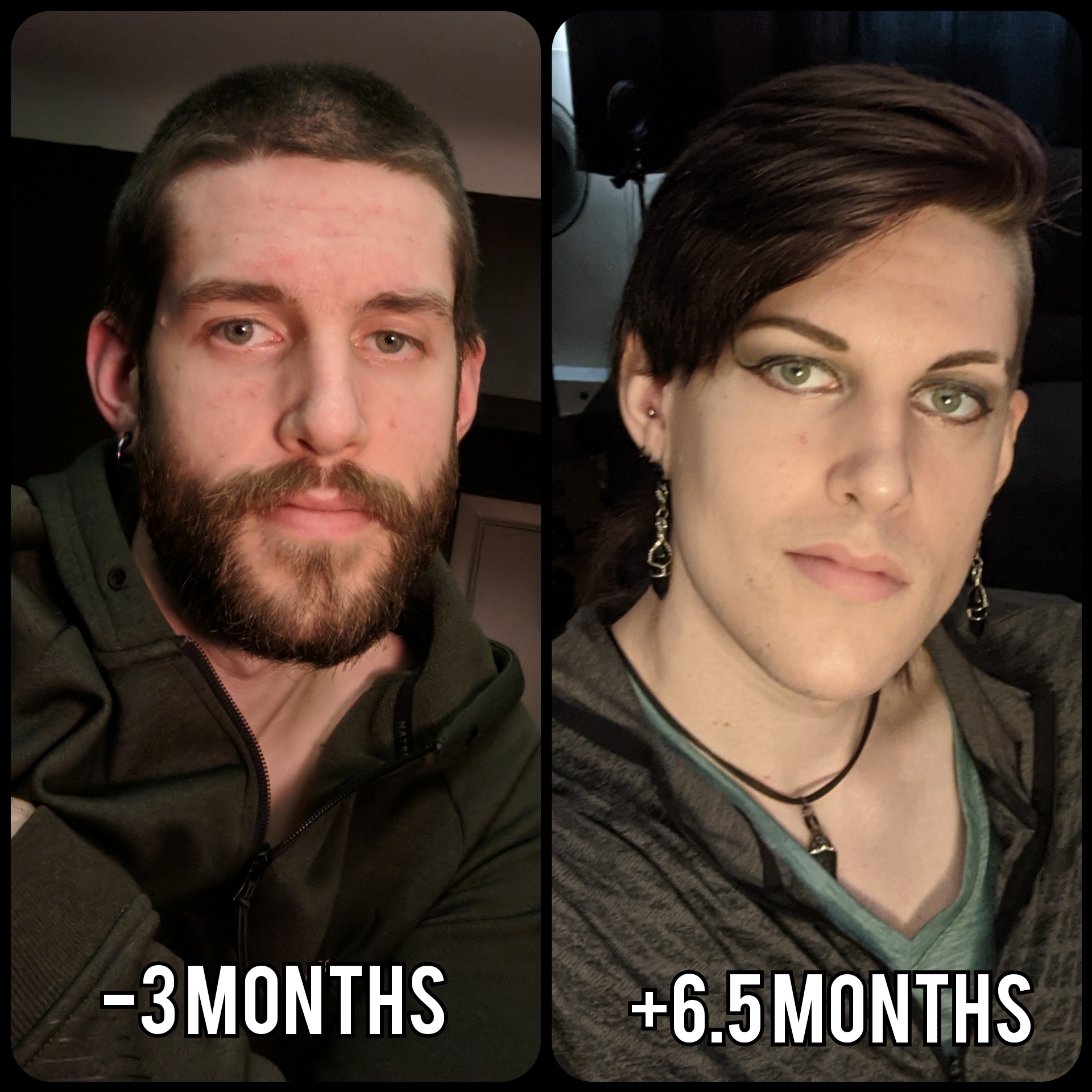 Starting to see some progress finally (MtF 6.5 months HRT) | Scrolller