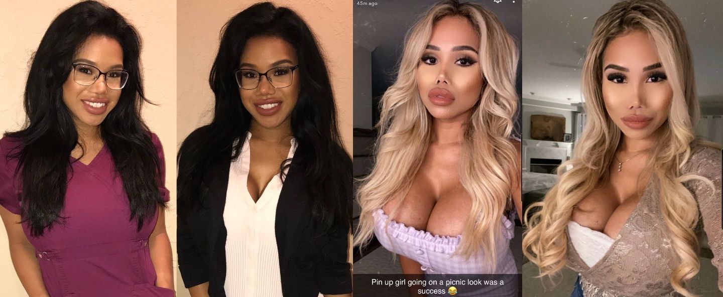 Stephanie Hills became a perfect 10 when she added plastic 💉👌 | Scrolller