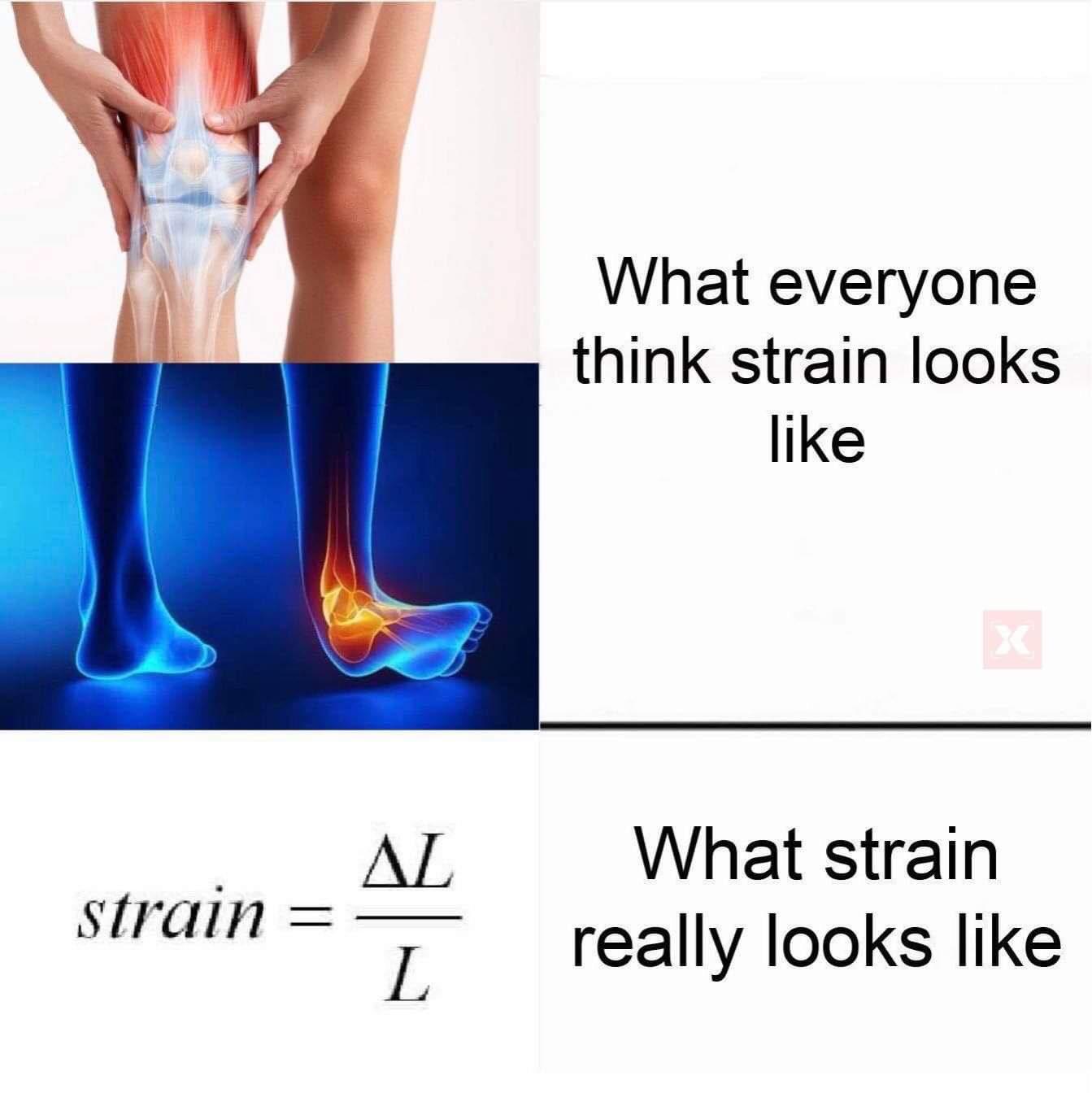 "Strain" | Scrolller