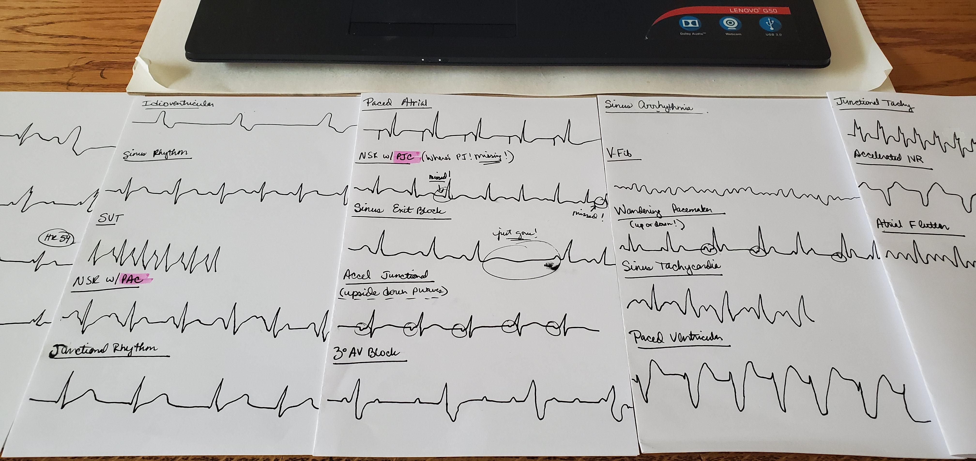 Studying for a cardiac quiz at work | Scrolller
