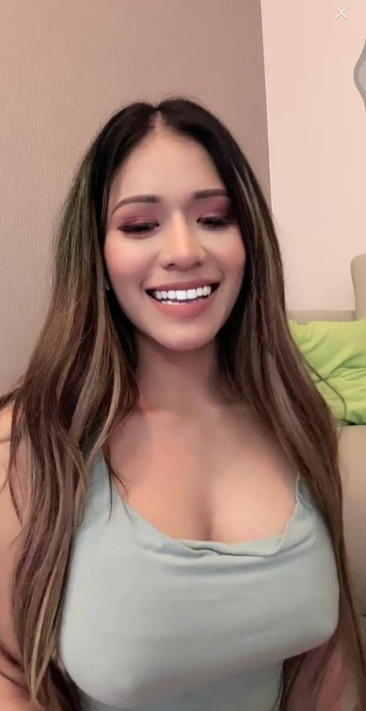 Surgery?looks bigger than before. | Scrolller