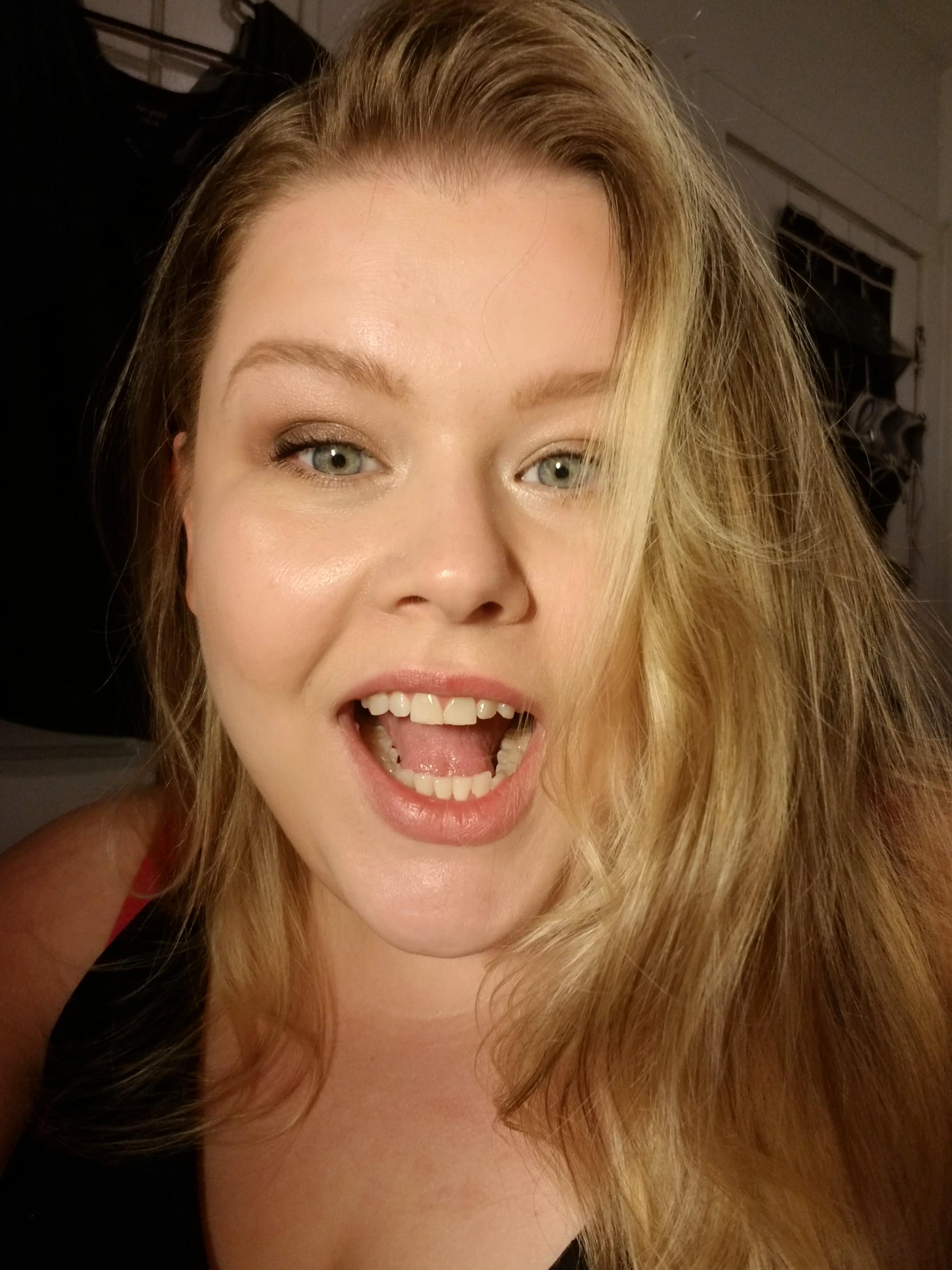 Thanks for the positivity everyone! Things are looking up. :) | Scrolller