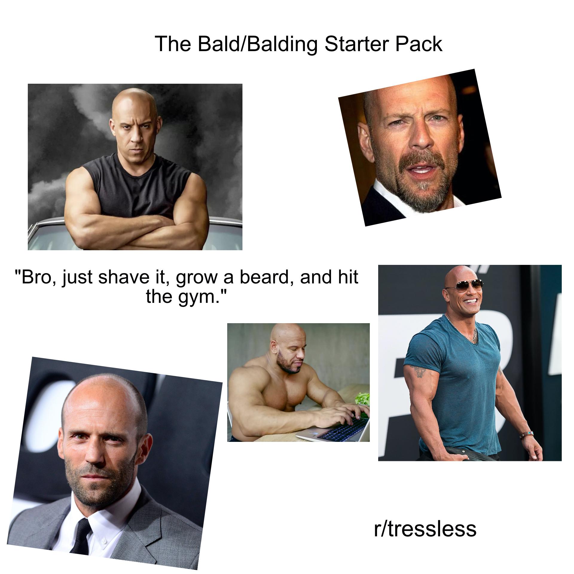 The "Bald/Balding" Starter Pack | Scrolller