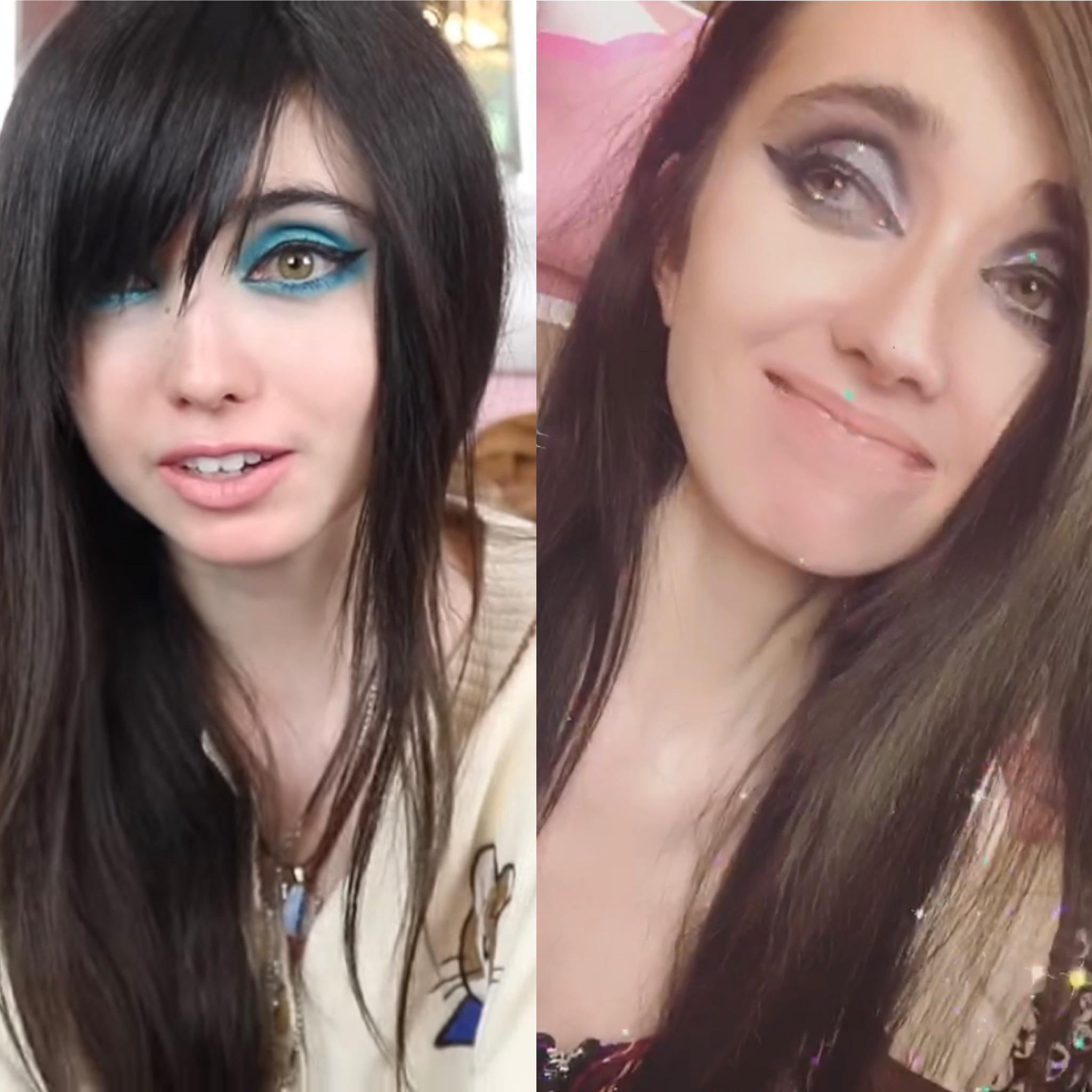 The disease is really showing in her face 😢 She was still underweight in the before picture but ...